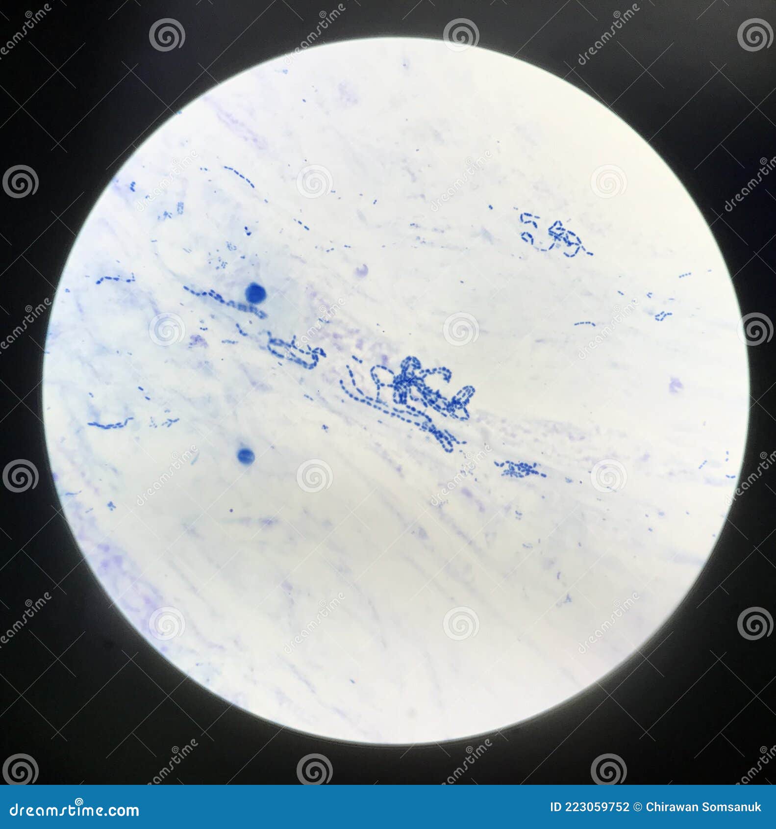 Close Up Blue Bacteria Cells. Stock Illustration - Illustration of ...
