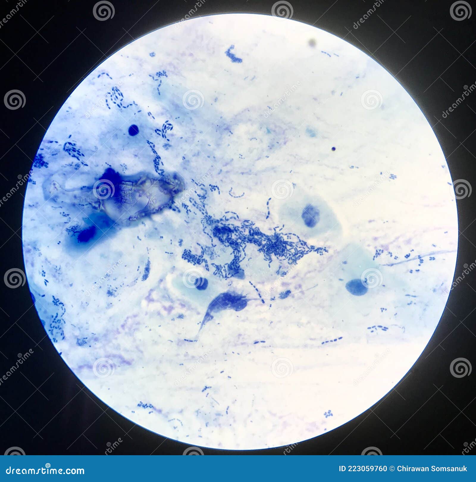 Close Up Blue Bacteria Cells. Stock Illustration - Illustration of ...