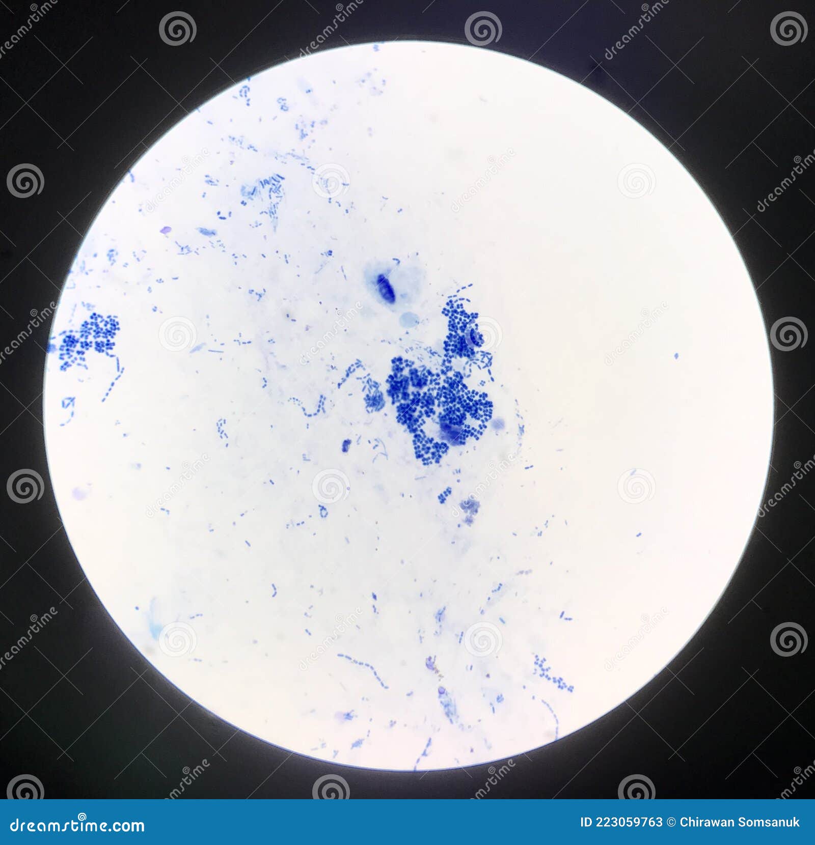 Close Up Blue Bacteria Cells. Stock Illustration - Illustration of ...