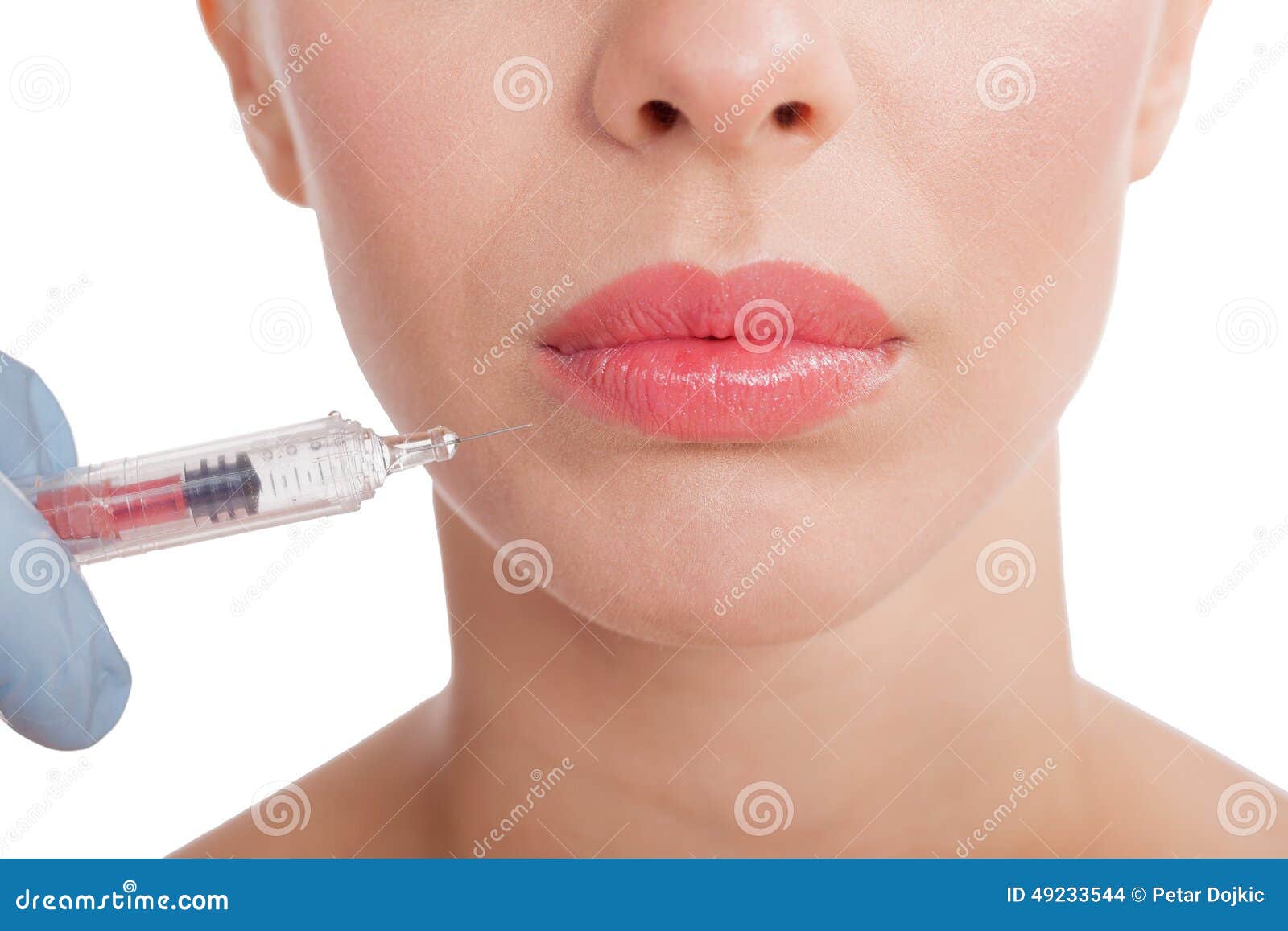 Close Up Botox Shot in the Female Lips Stock Photo - Image of female ...