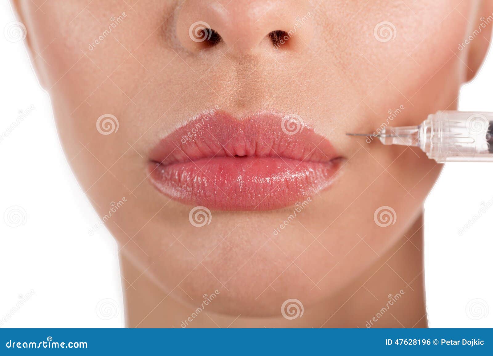 Close Up Botox Shot in the Female Lips,isolated Stock Photo - Image of ...