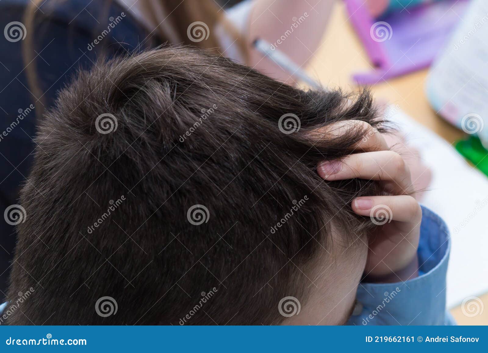 Close-up of the Boy S Hand Supporting His Head by the Forehead. Stock ...