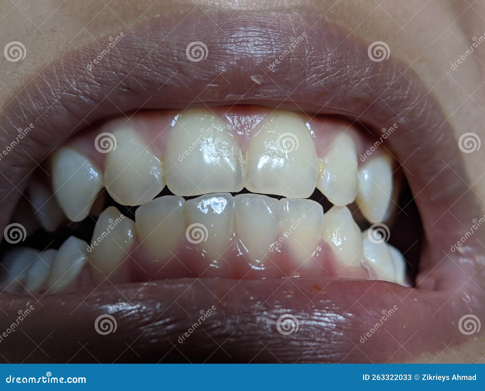 Close-up of Boy Teeth Texture Stock Image - Image of close, mouth ...