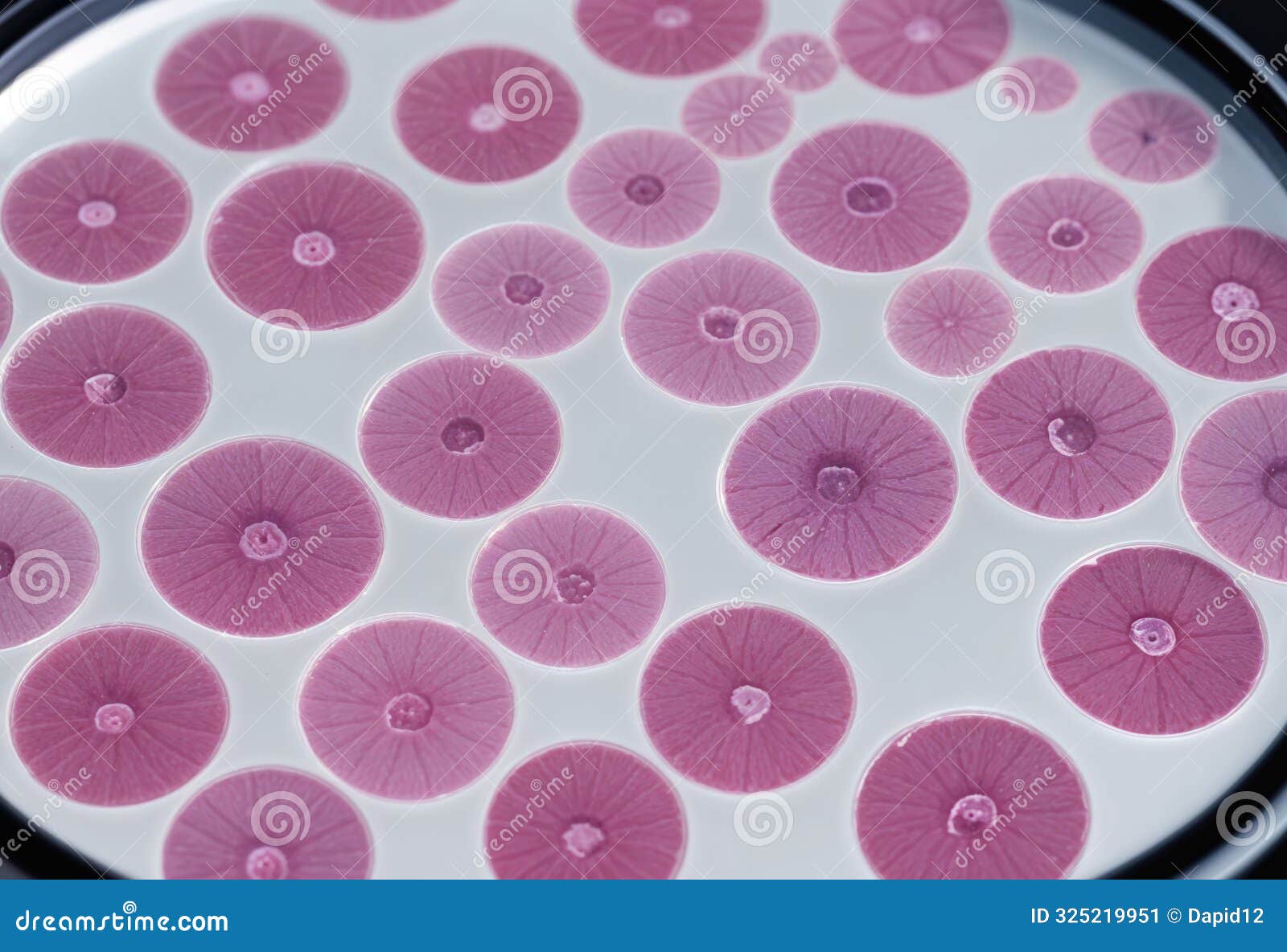 A Close Up of a Cell Culture Dish with Pink Stained Cells Under a ...