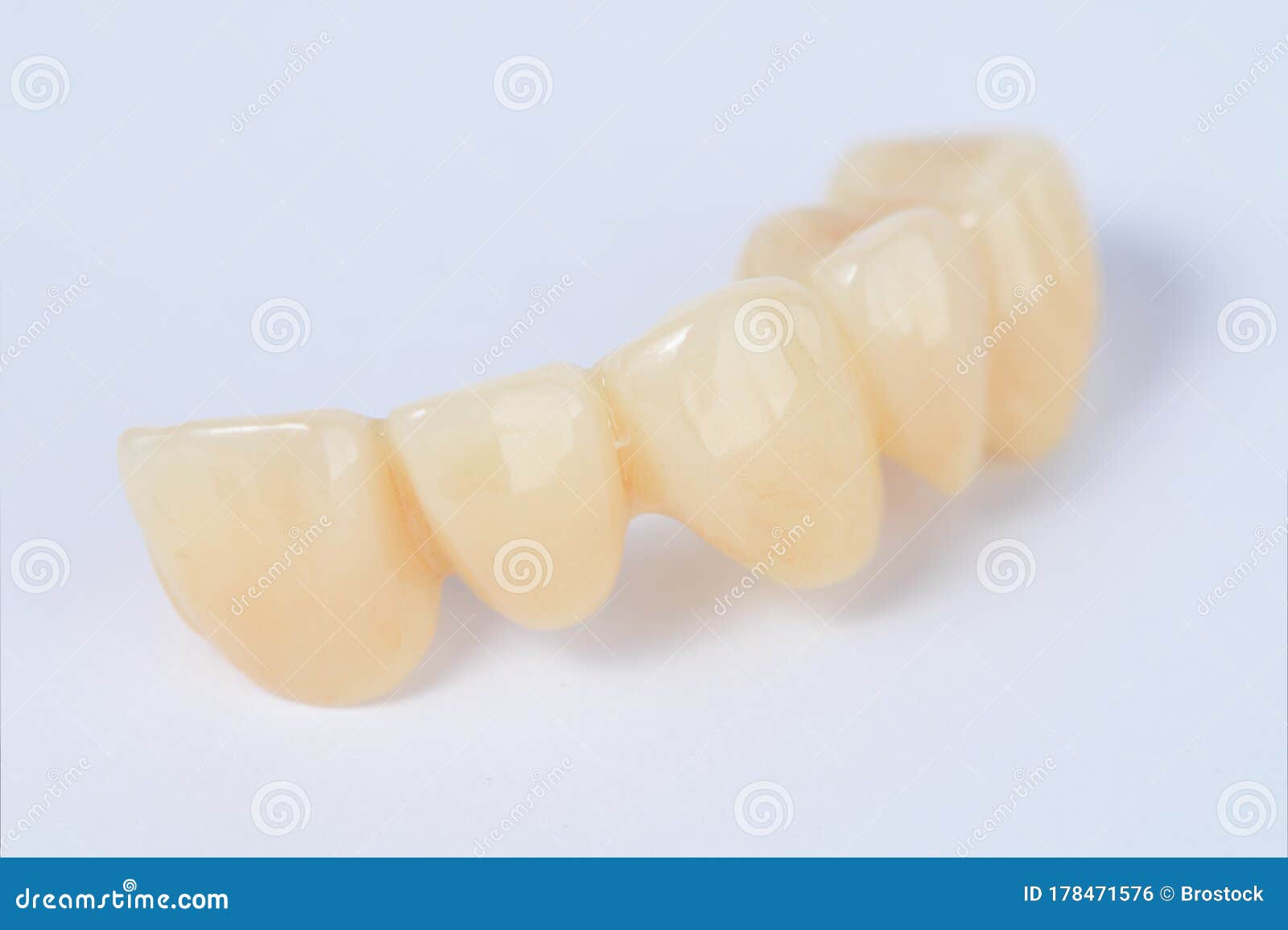 Close Up Ceramic Tooth Crown Stock Photo - Image of health, implant ...