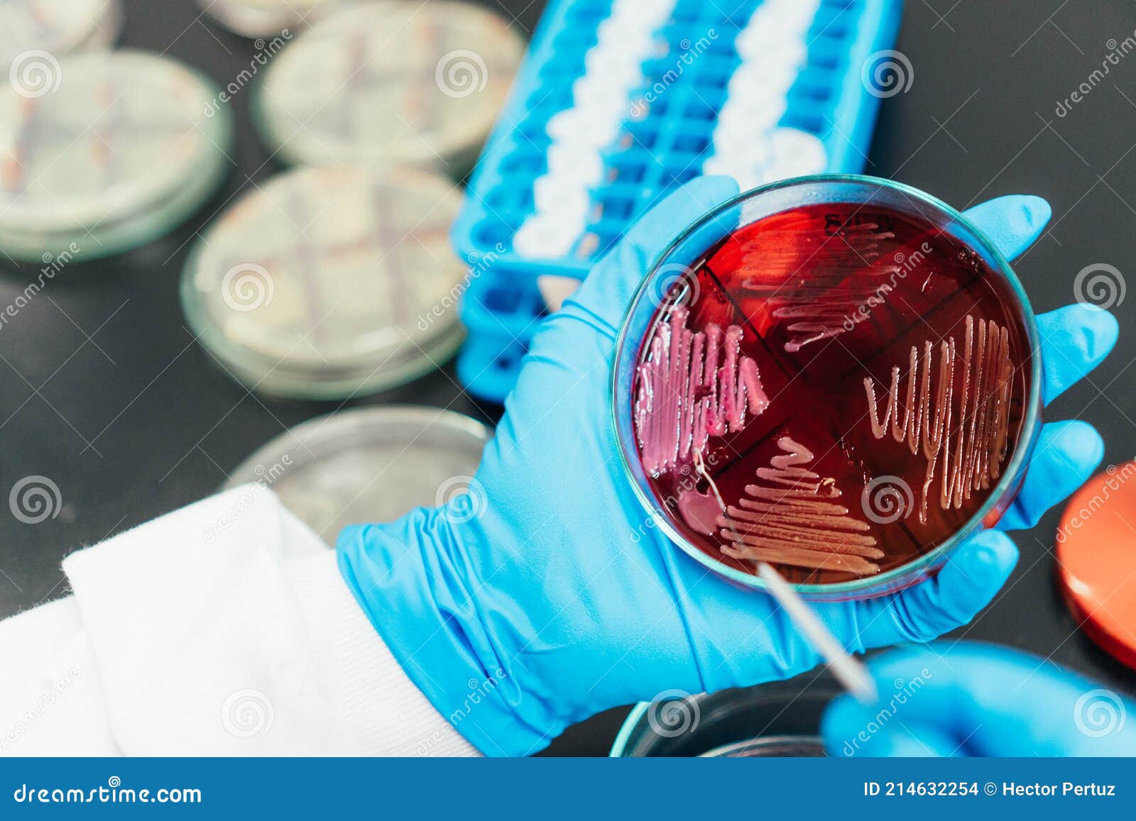 Close-up of a Chemist Using a Loop To Take a Sample from a Petri Dish ...