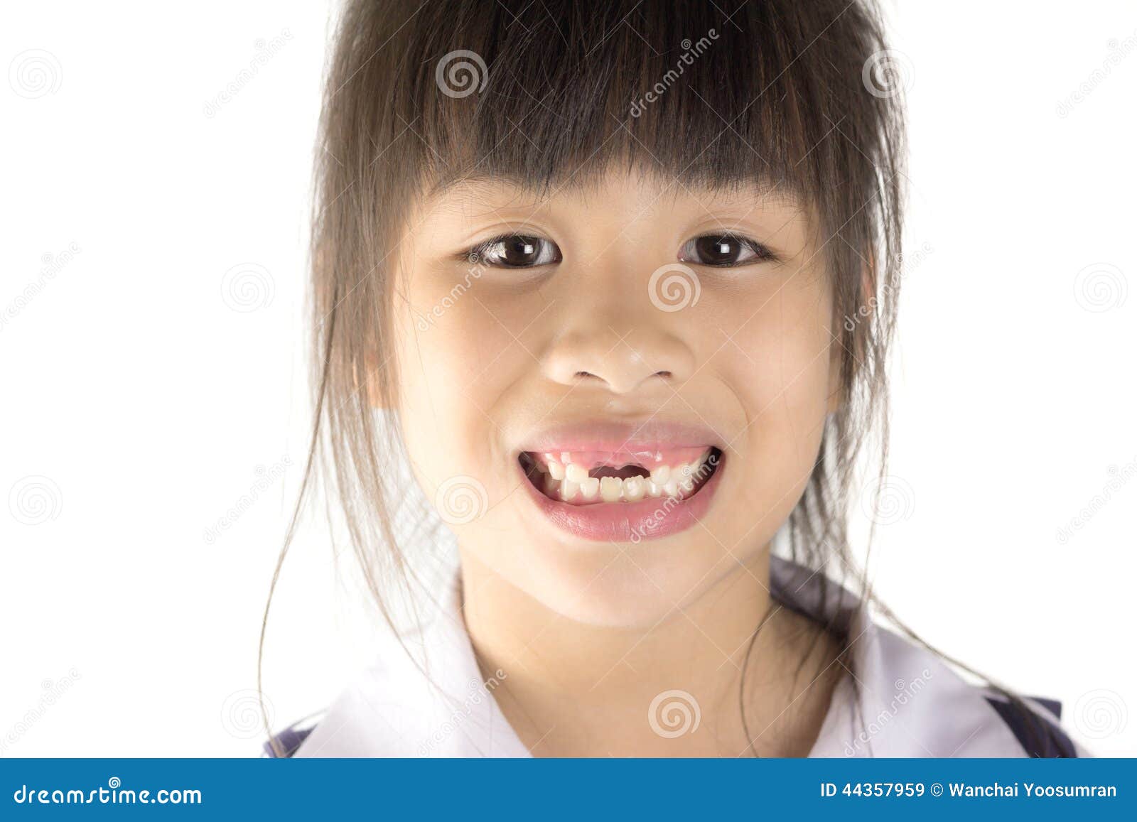 Close Up Child S Month with Missing Teeth Stock Image - Image of girl ...