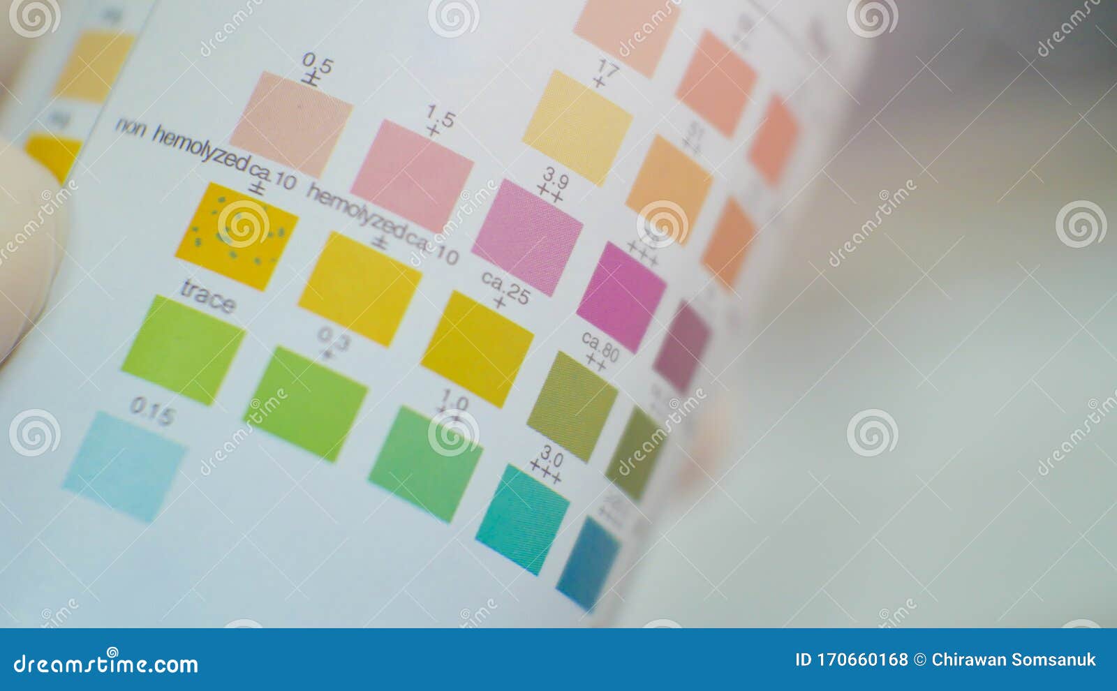 Close Up Color Level in Urine Strip Test Stock Photo - Image of ...