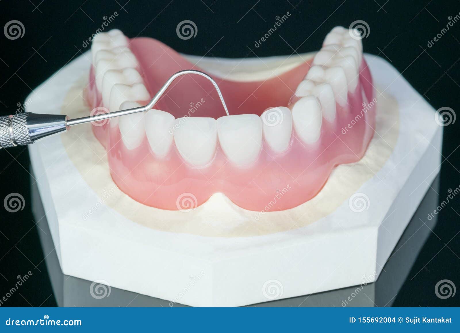 Complete Denture or Full Denture. Stock Photo - Image of artificial ...