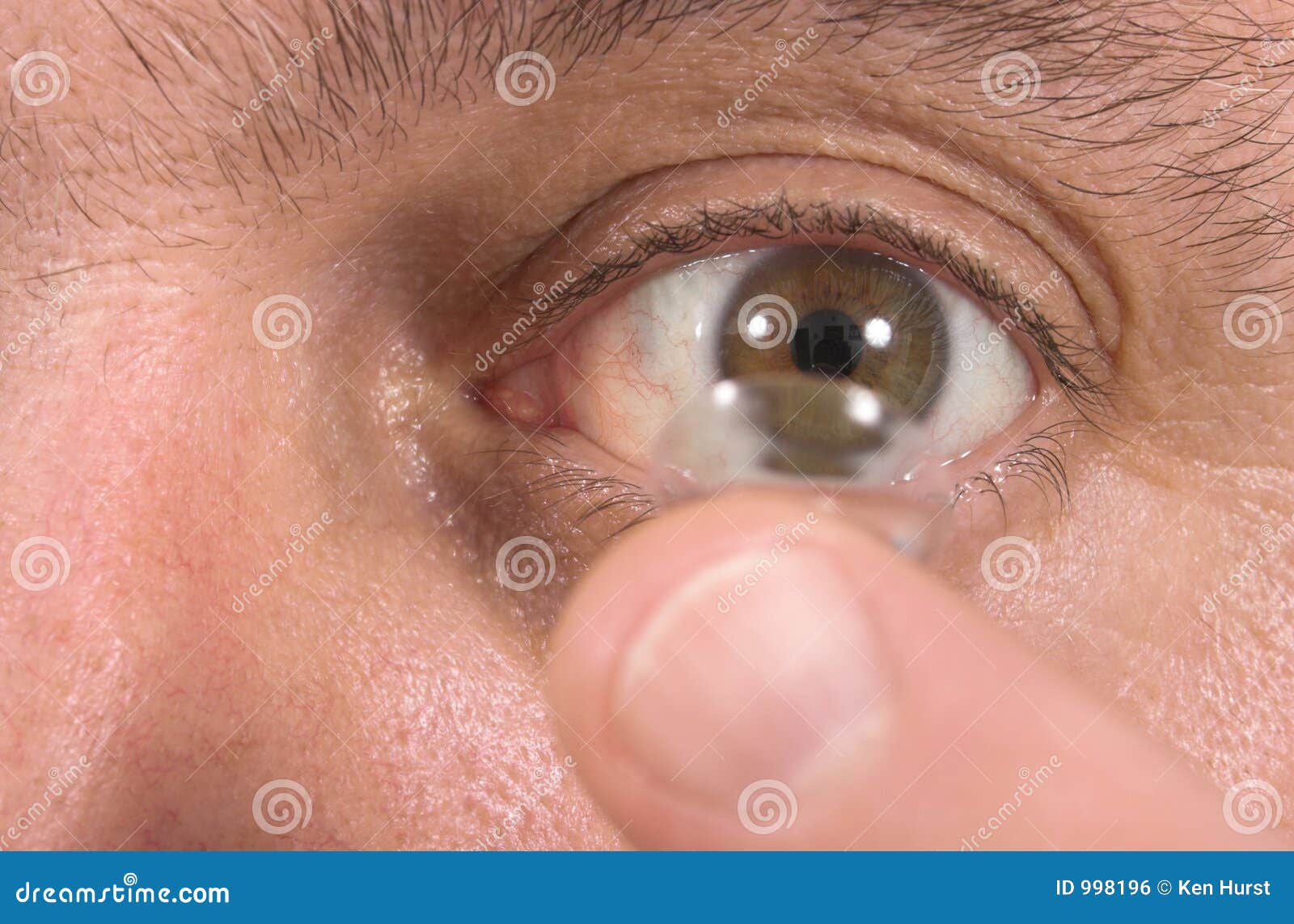 Close-Up of Contact Lens and Eye 2 Stock Photo - Image of cornea, macro ...