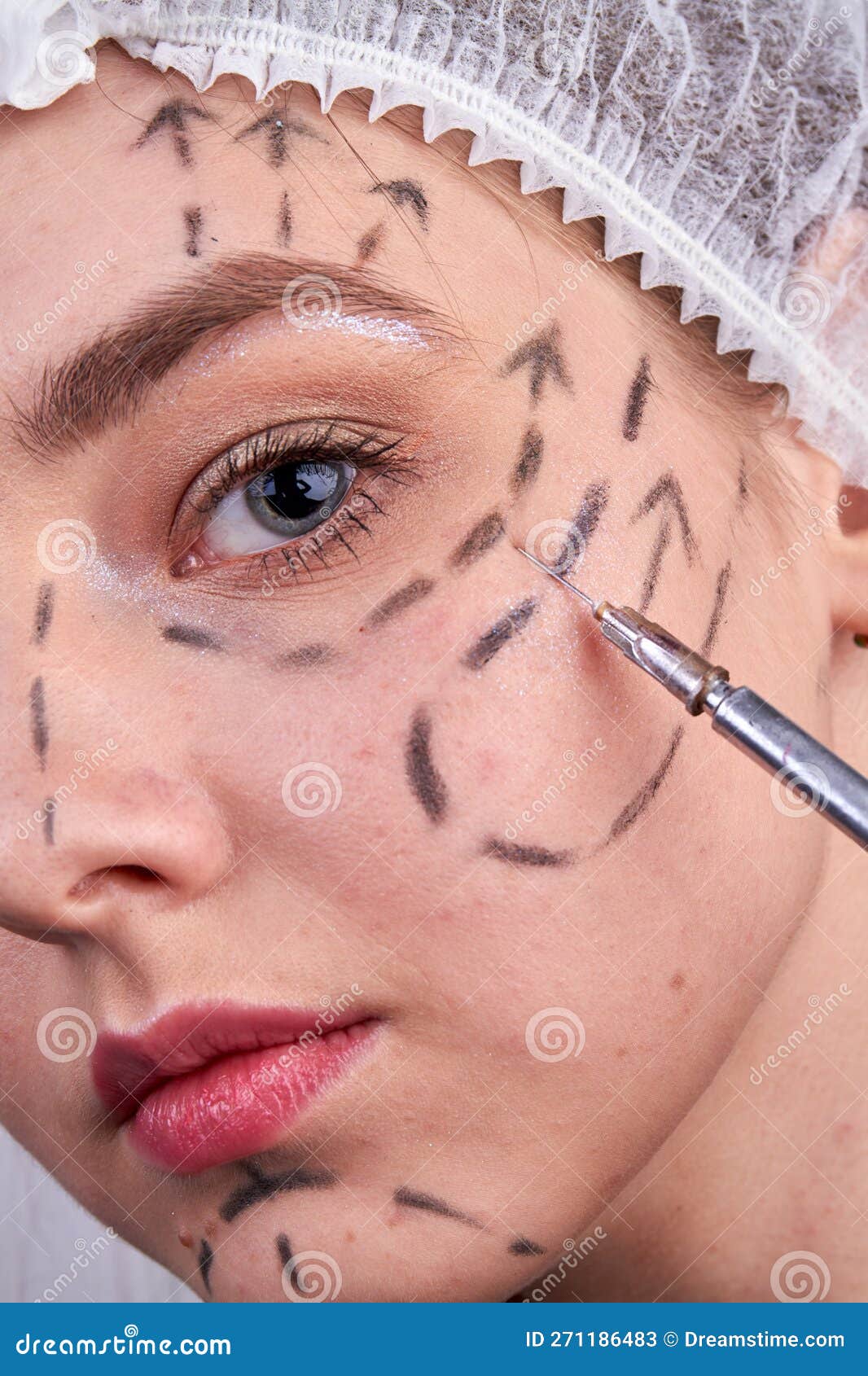 Close Up Cosmetic Botox Injection In Young Woman Face Stock Image