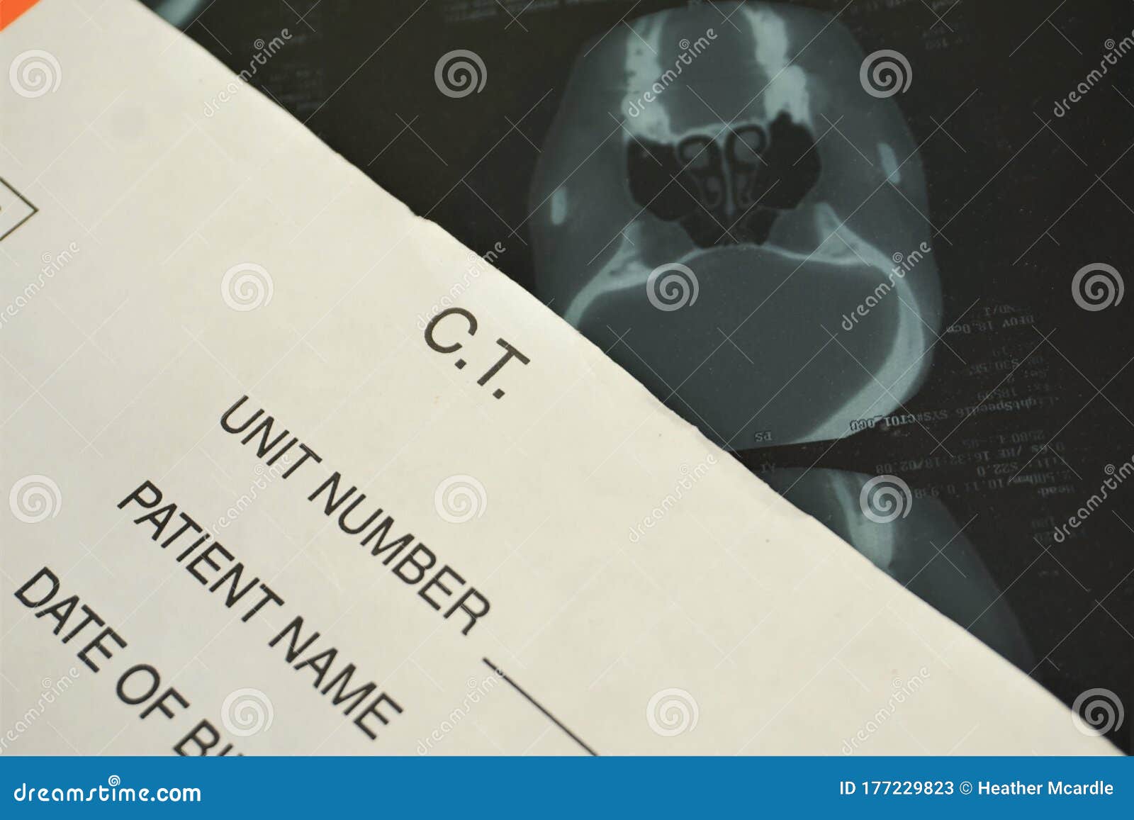 Close Up of CT Scan Films of Skull and Packaging Stock Image - Image of ...