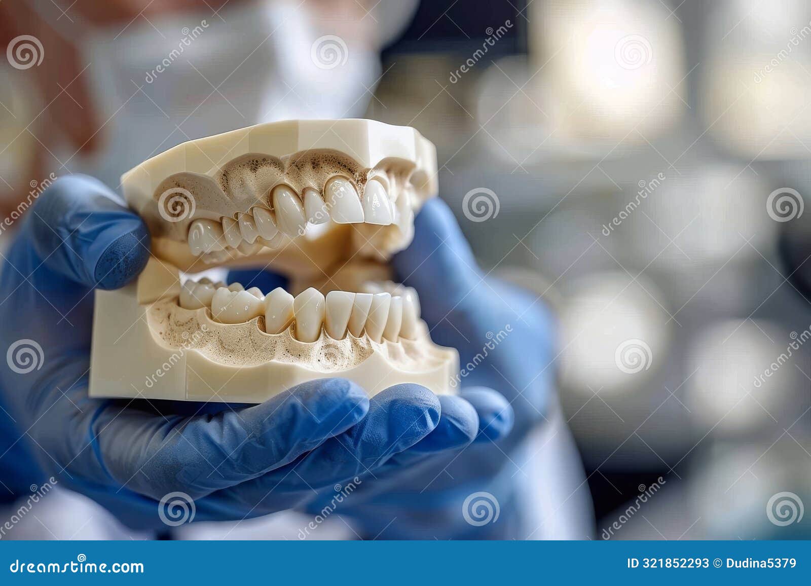 Close-up of Dental Technician with Prosthetic Teeth Model in Lab Stock ...