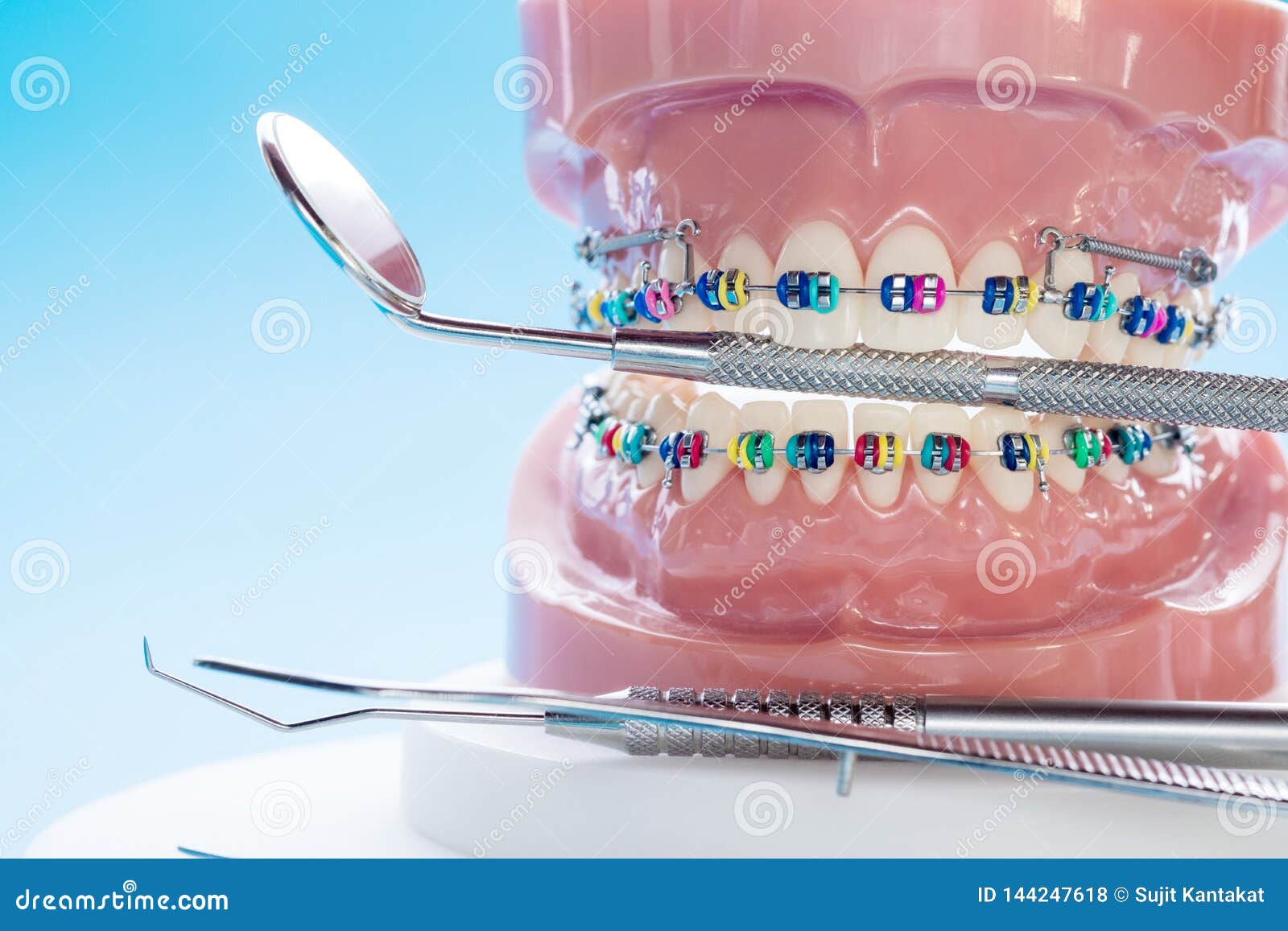 Close Up Dentist Tools and Orthodontic Model. Stock Photo - Image of ...