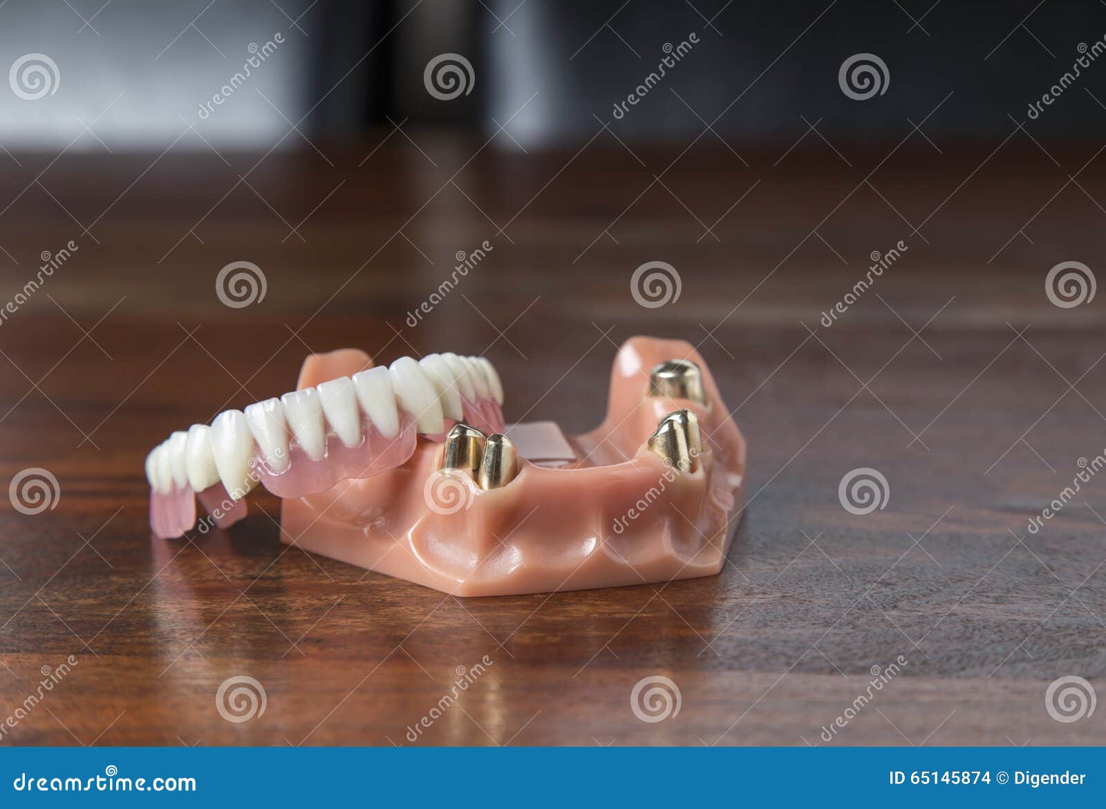 Close Up of Dentures with Gold Teeth Stock Photo - Image of space, gold ...