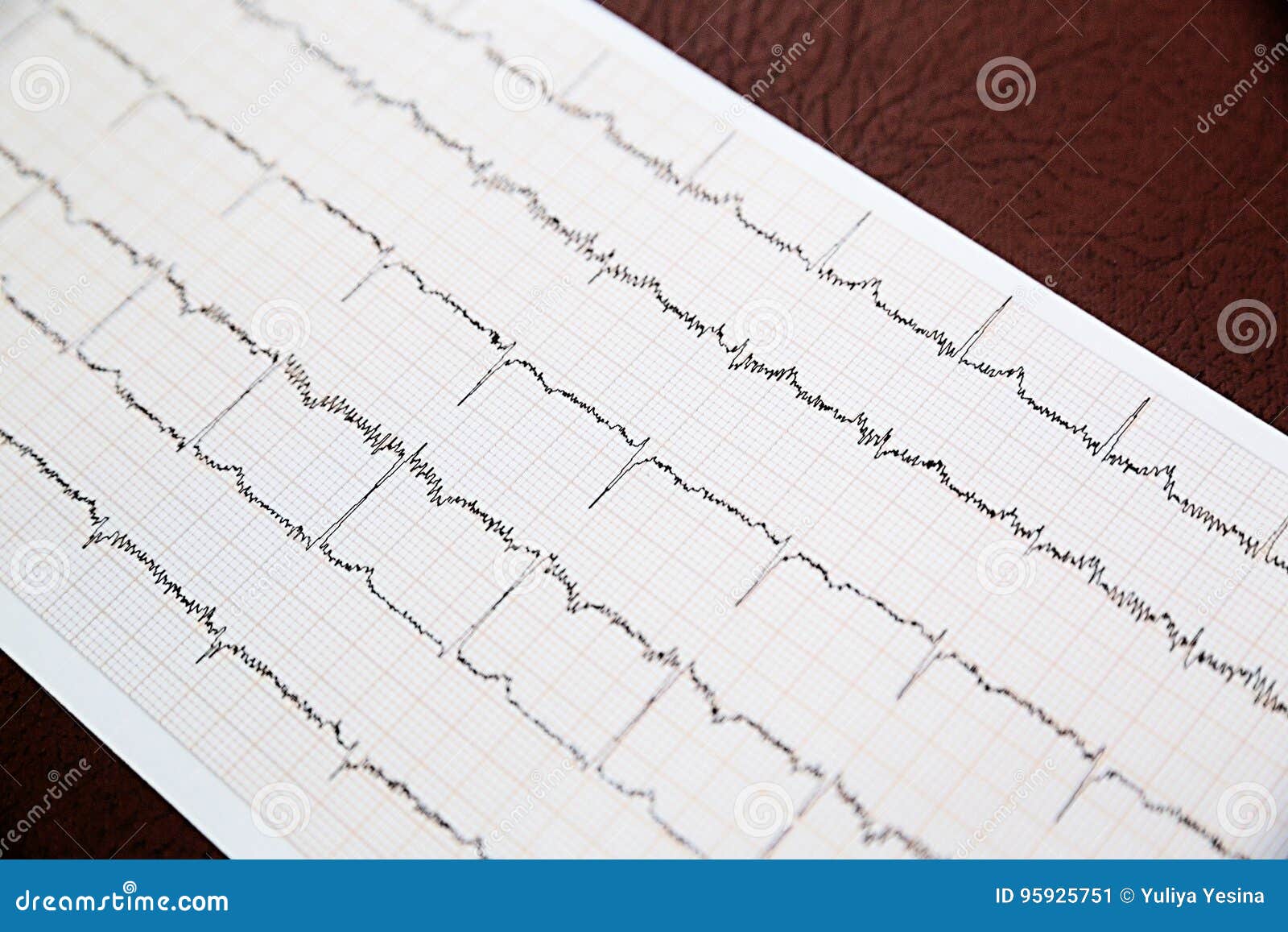 Close Up Of An Electrocardiogram In Paper Form Vith Red Wooden Heart ...
