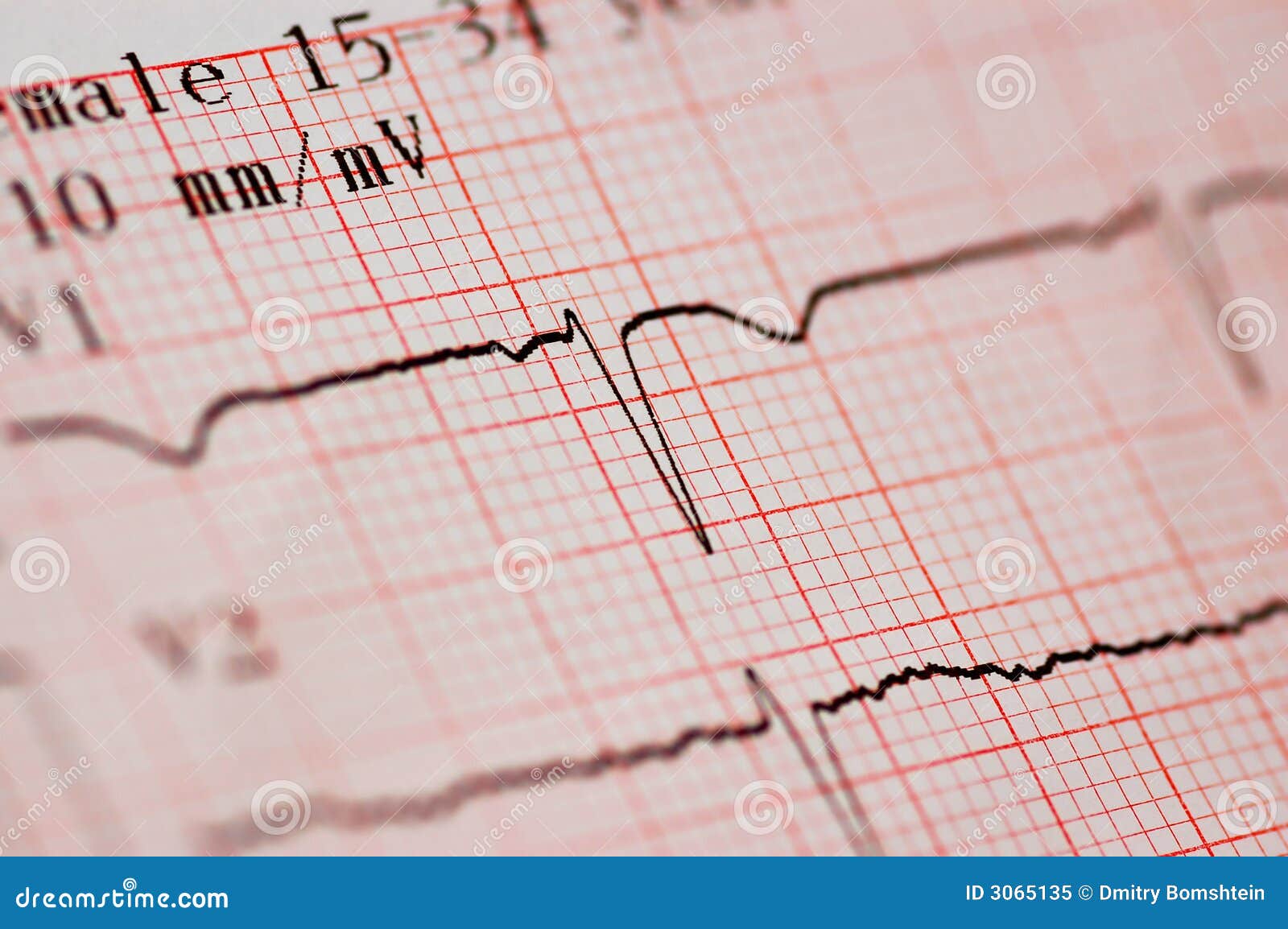 Close up of ecg graph stock image. Image of form, macro - 3065135