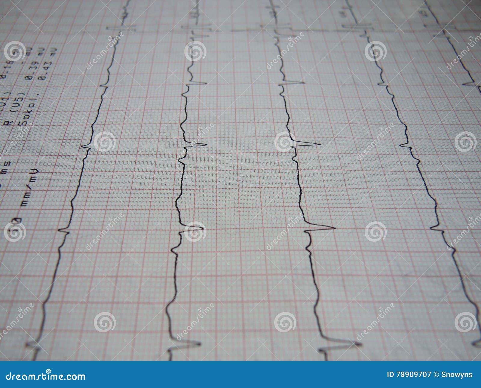 Close up of ECG graph stock image. Image of checkup, graph - 78909707