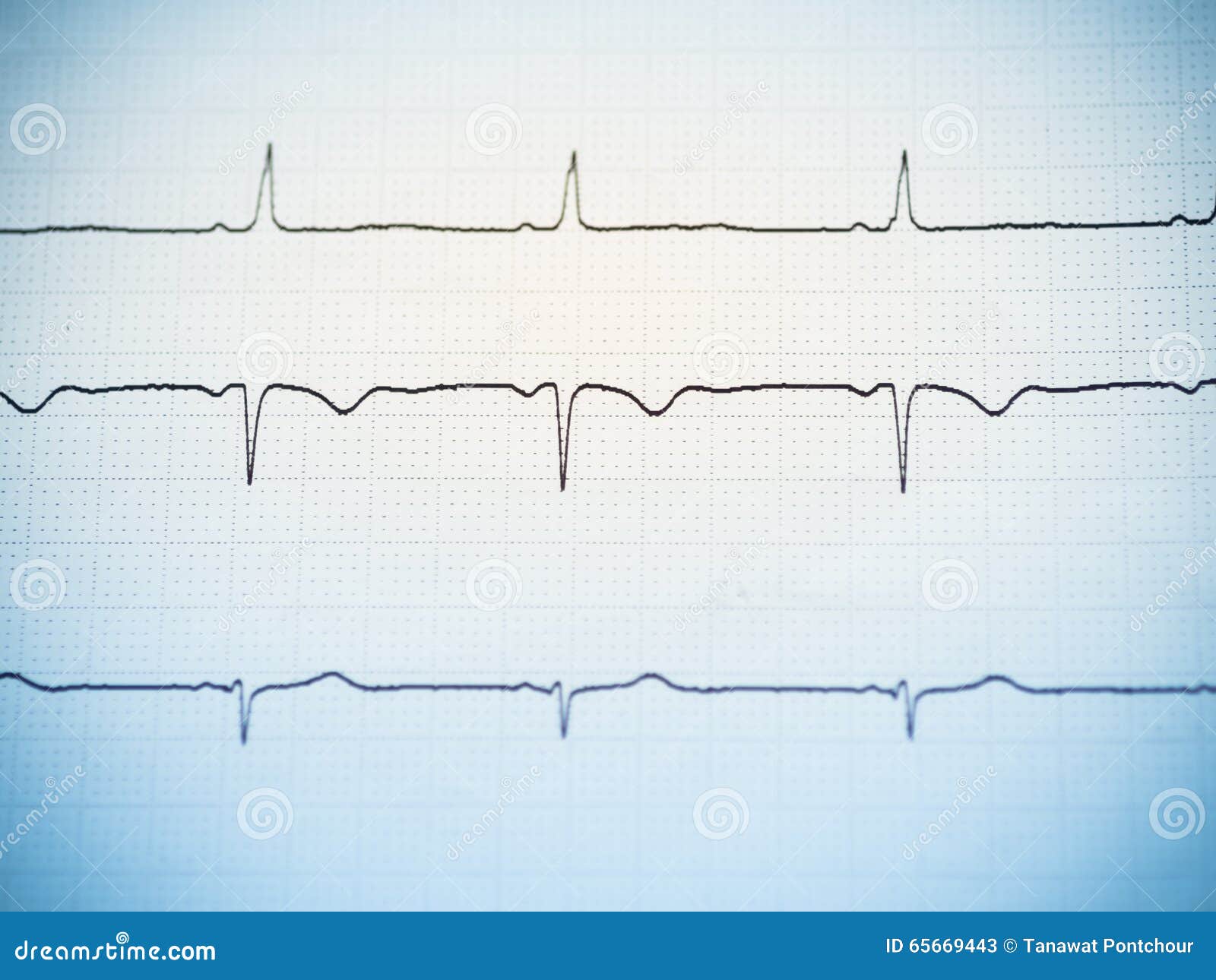 Close Up of an Electrocardiogram. Stock Image - Image of cardiac, close ...