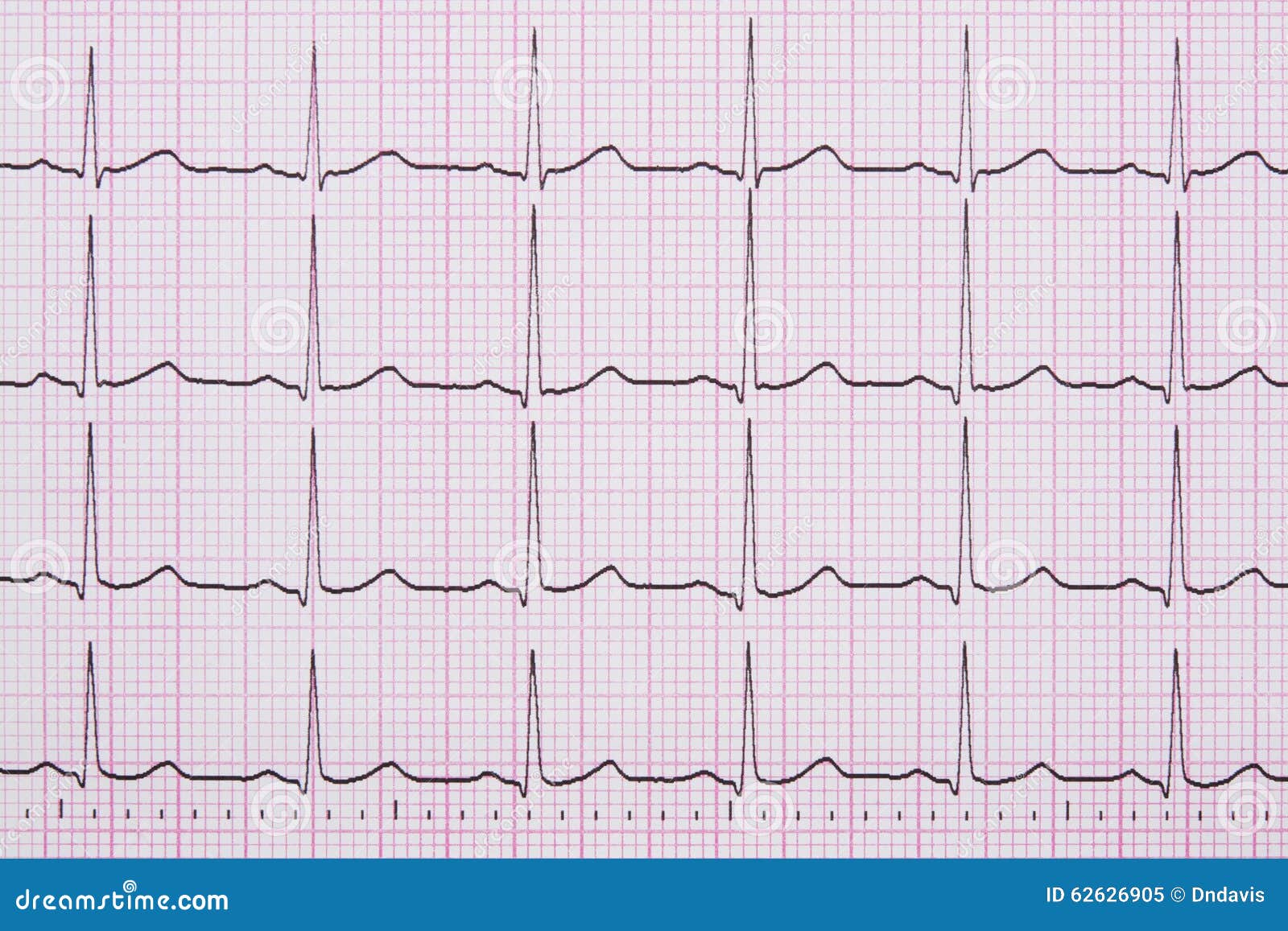 Close Up of a Electrocardiograph Also Known As a EKG Stock Image ...