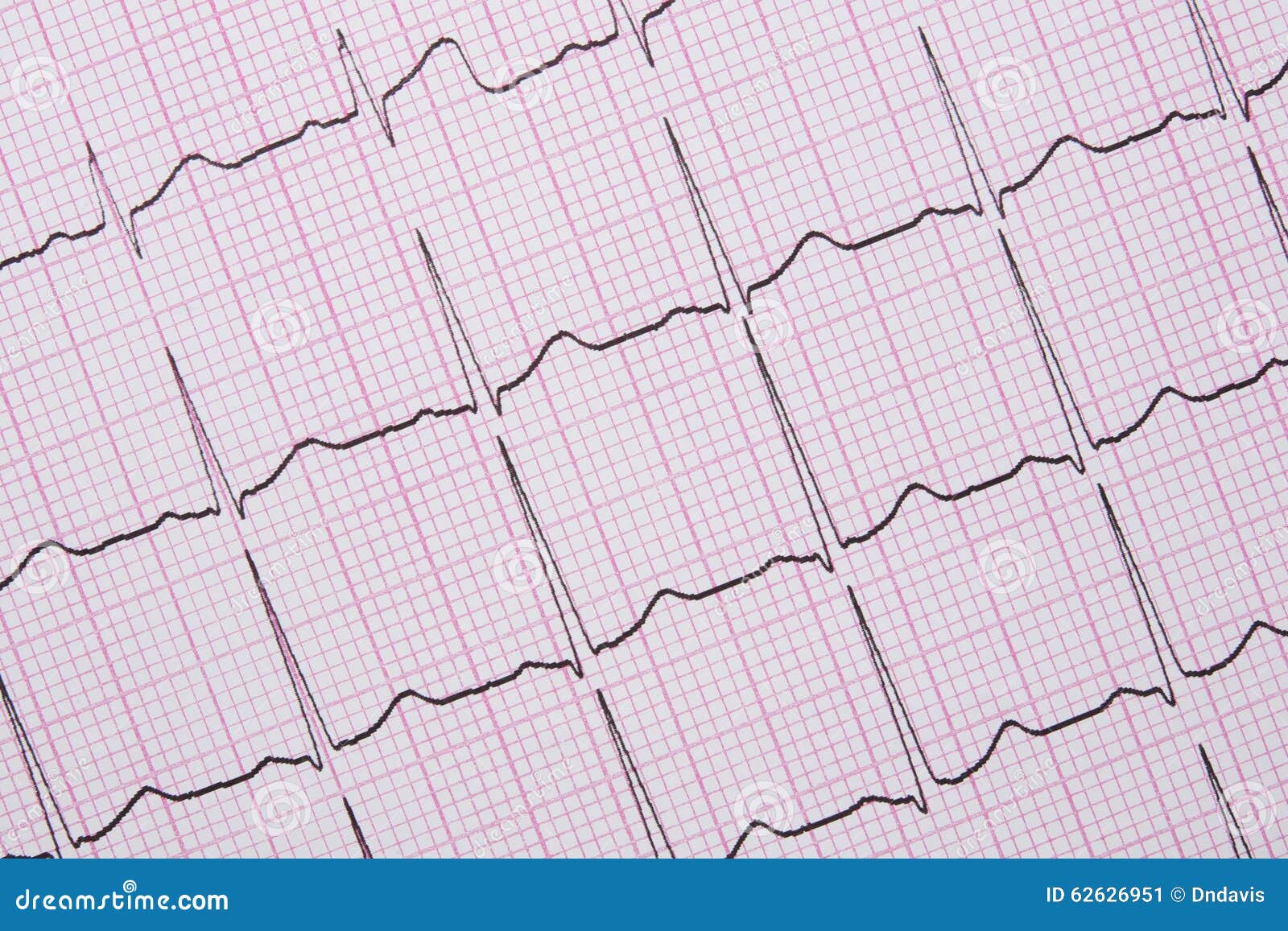 Close Up of a Electrocardiograph Also Known As a EKG Stock Image ...