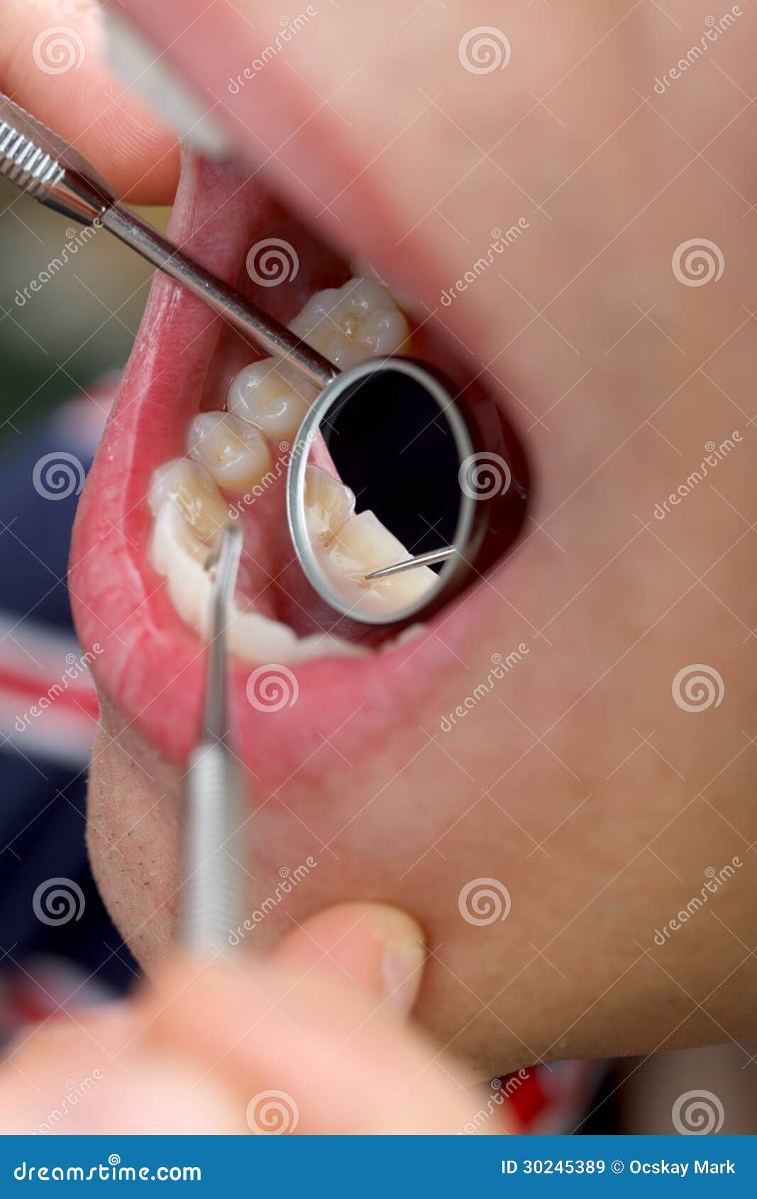 Extensive Dental Examination Stock Image - Image of lips, exam: 30245389