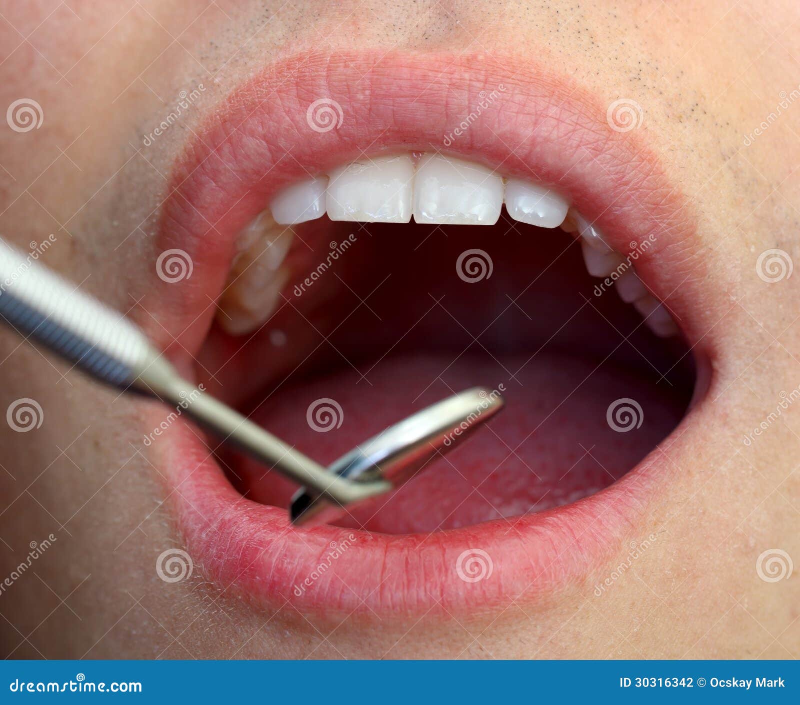 Dental examination stock photo. Image of health, lips - 30316342