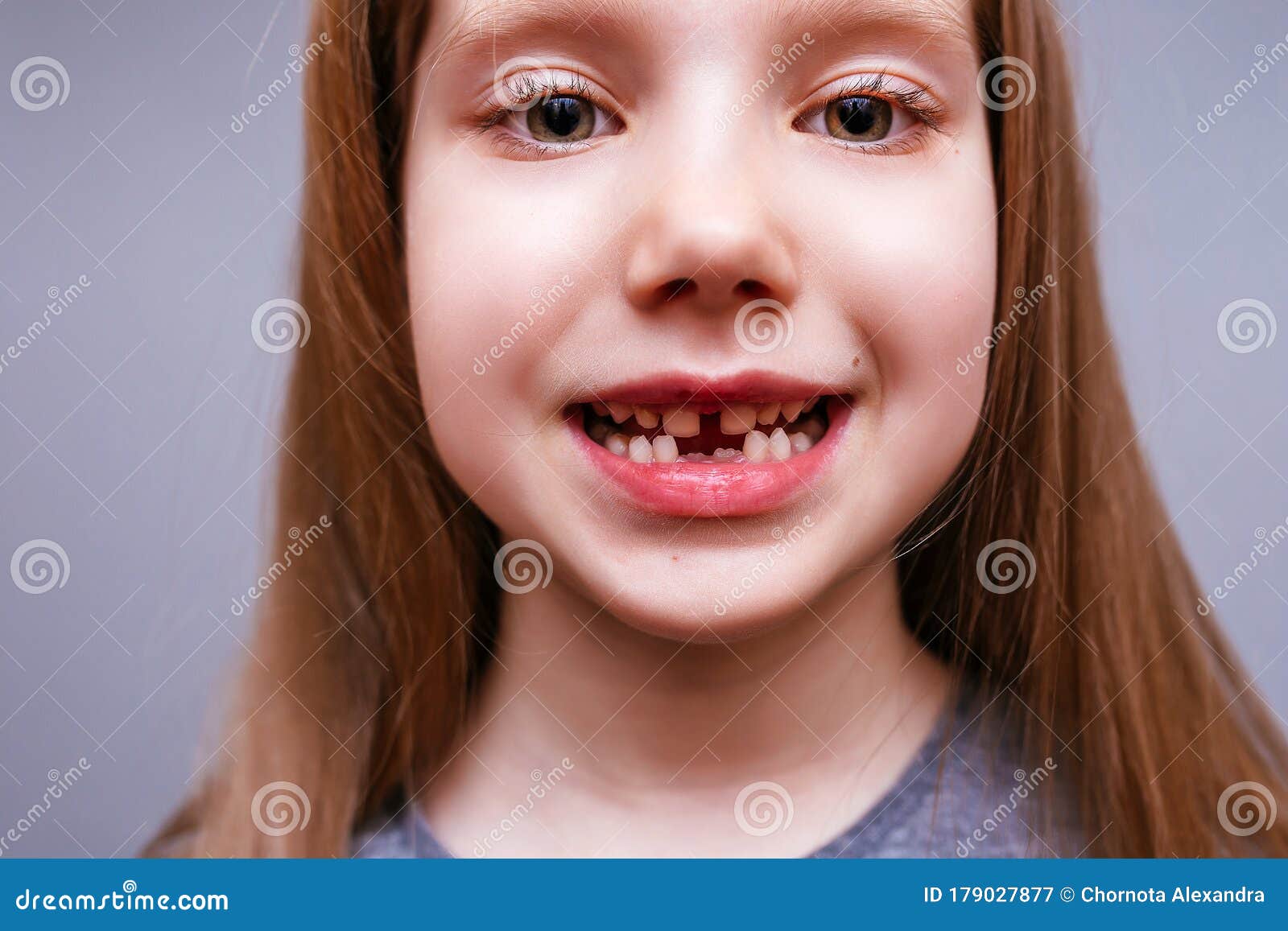 Close-up Face of a Girl Whose Lower Milk Teeth Fell Out Stock Image ...