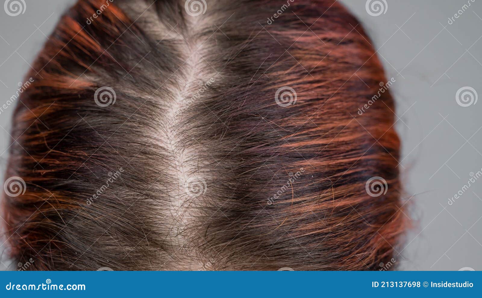 Close-up of a Female Head Parting. Stock Photo - Image of wellness ...