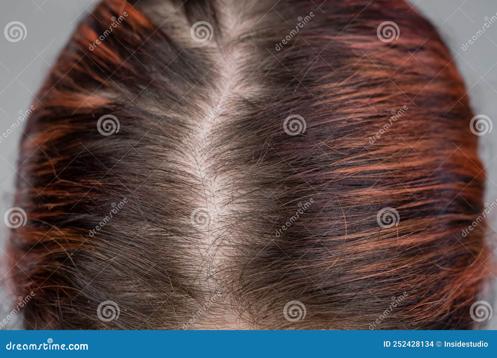 Close-up of a Female Head Parting. Stock Photo - Image of ginger ...