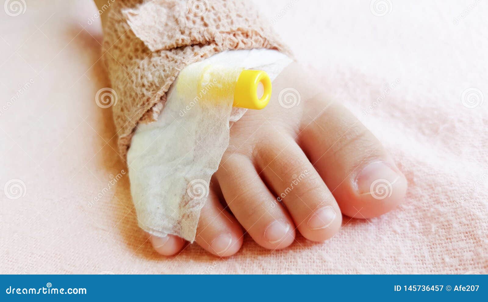 Close-up Foot of Child Patient with Saline Solution Drip Stock Image ...