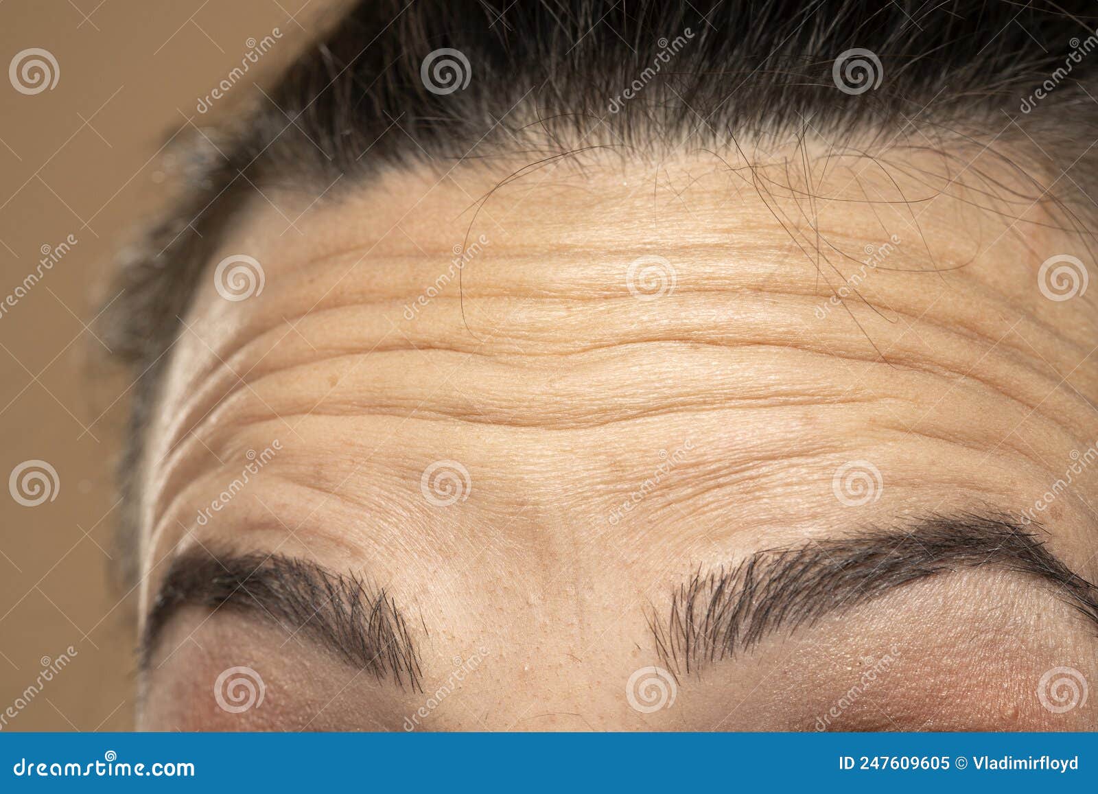 Close Up of Forehead with Wrinkles of Young Woman Stock Image - Image ...