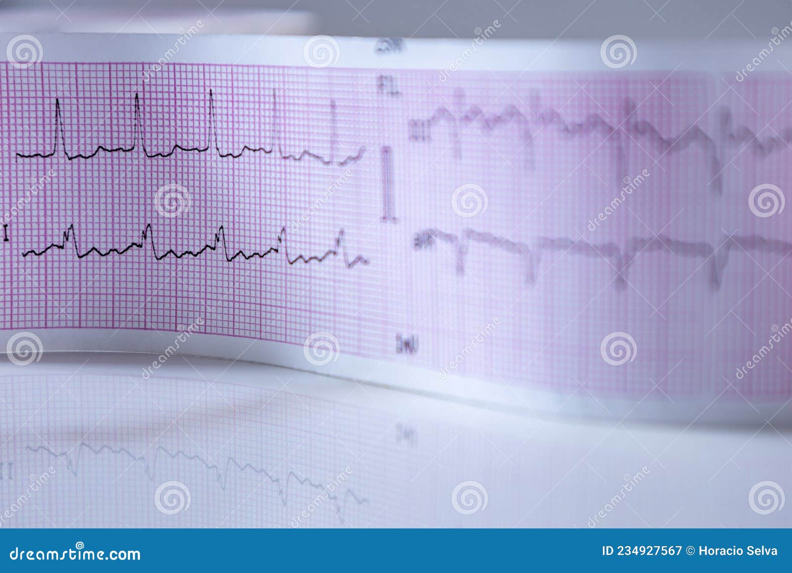 Ekg Graph Electrocardiogram Ekg Ecg With Red Blurred Heart Royalty Free