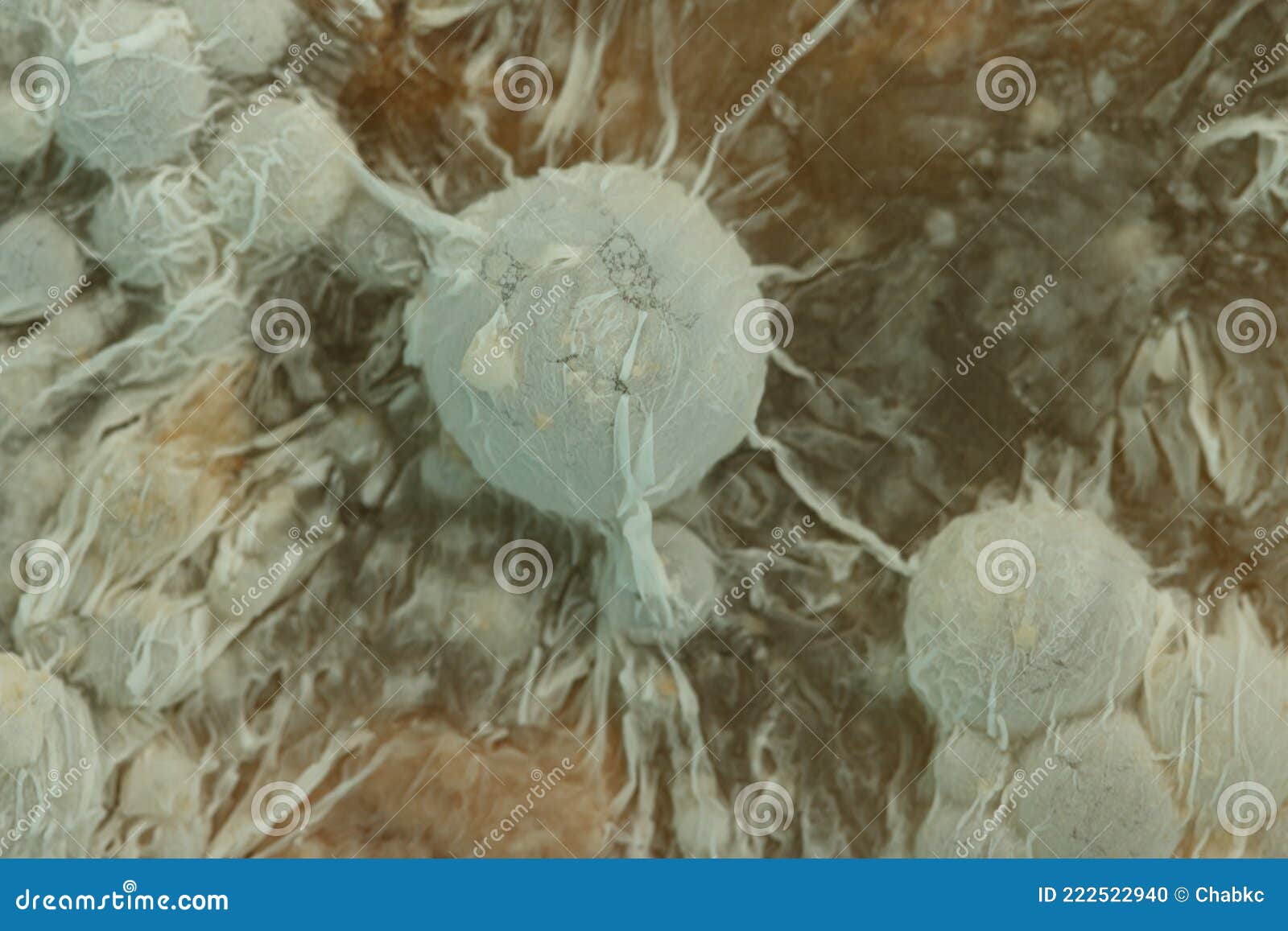 Bacteria and Microorganisms from Termite Nest. Stock Photo - Image of ...