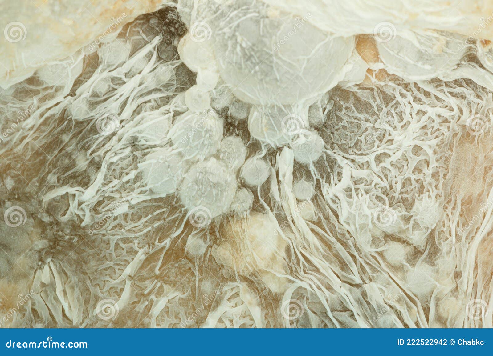 Bacteria and Microorganisms from Termite Nest. Stock Photo - Image of ...