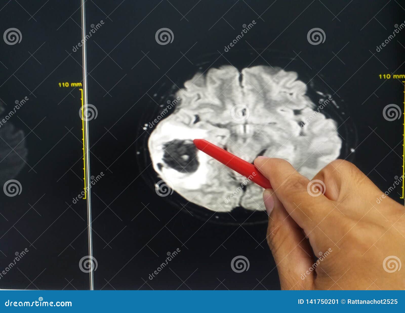 Examination Of The Brain With MRI. Doctor In Emergency Order Scans ... Examination Of The Brain With MRI. Doctor In Emergency Order Scans ...