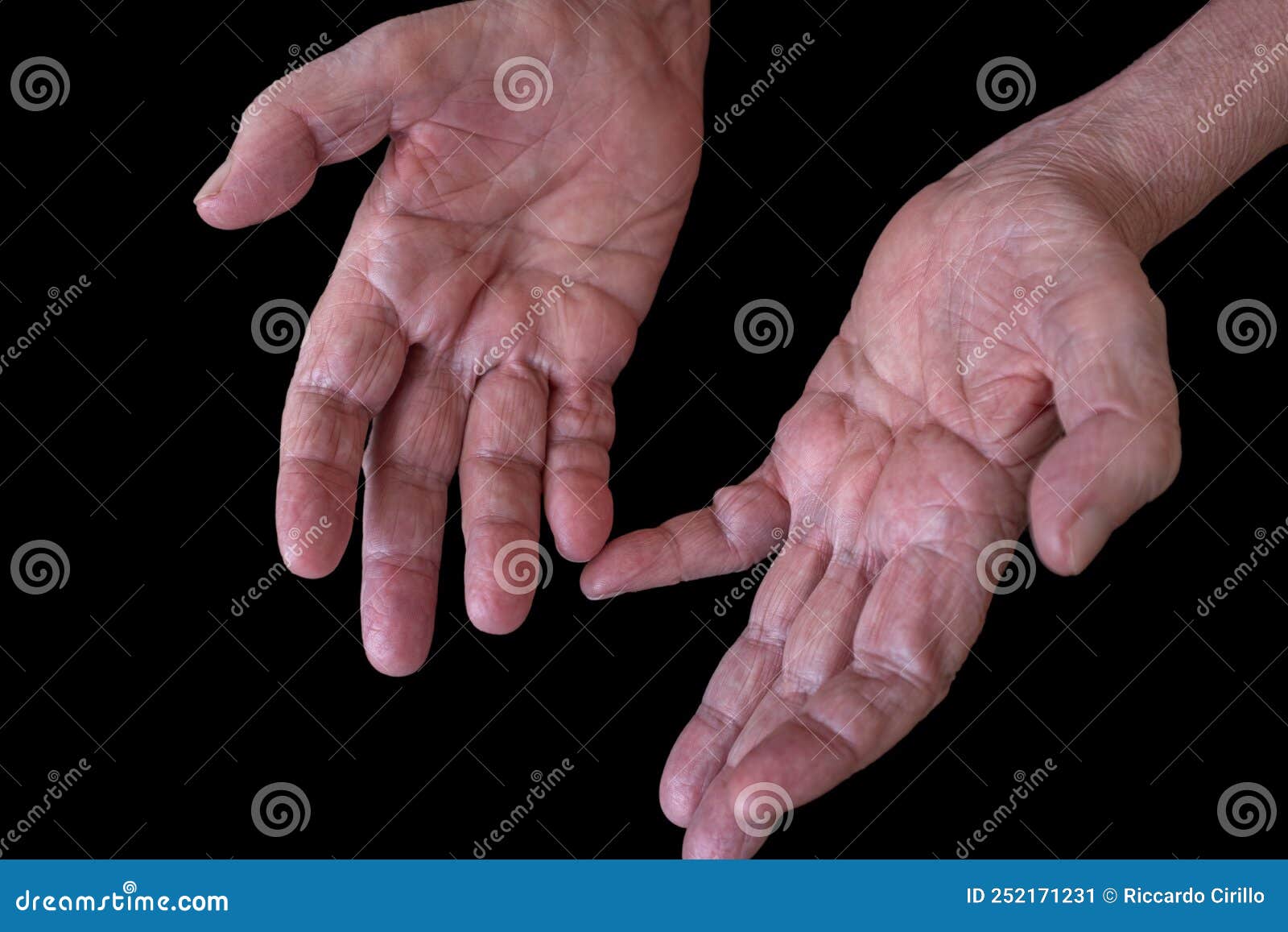 Top View of Elderly Male Hands with Open Palms. Senior Male Hands ...