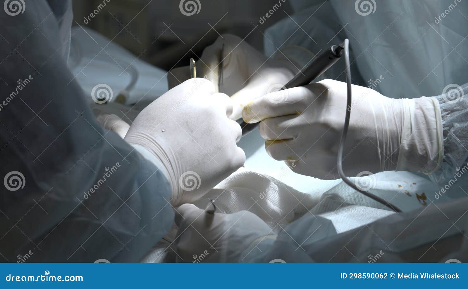 Close Up of Hands of Surgeons Team during Operation with Surgical ...