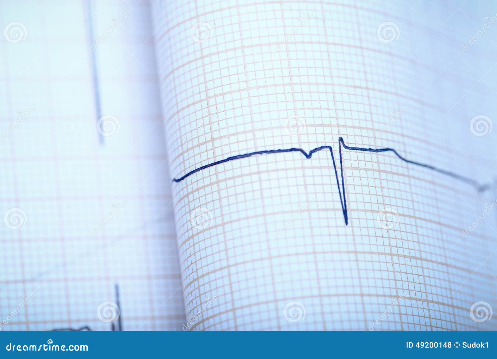 Close-up of Heart Complex on ECG Paper Stock Photo - Image of file ...