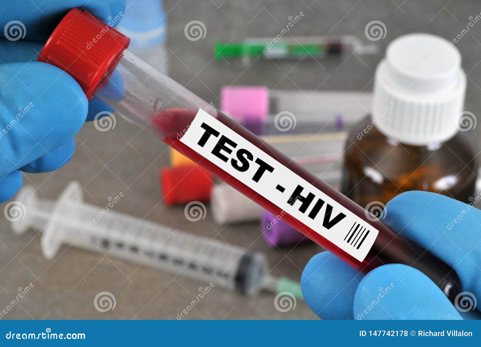 HIV test in close-up stock photo. Image of laboratory - 147742178