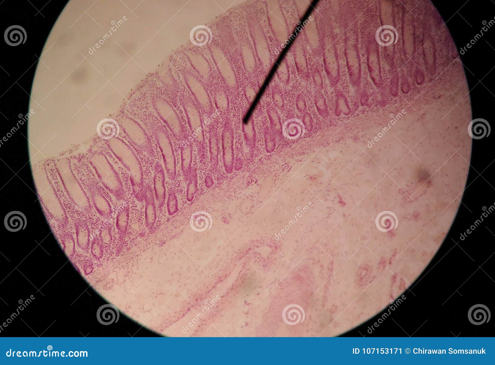 Close Up Human Cells with Microscope. Stock Image - Image of background ...