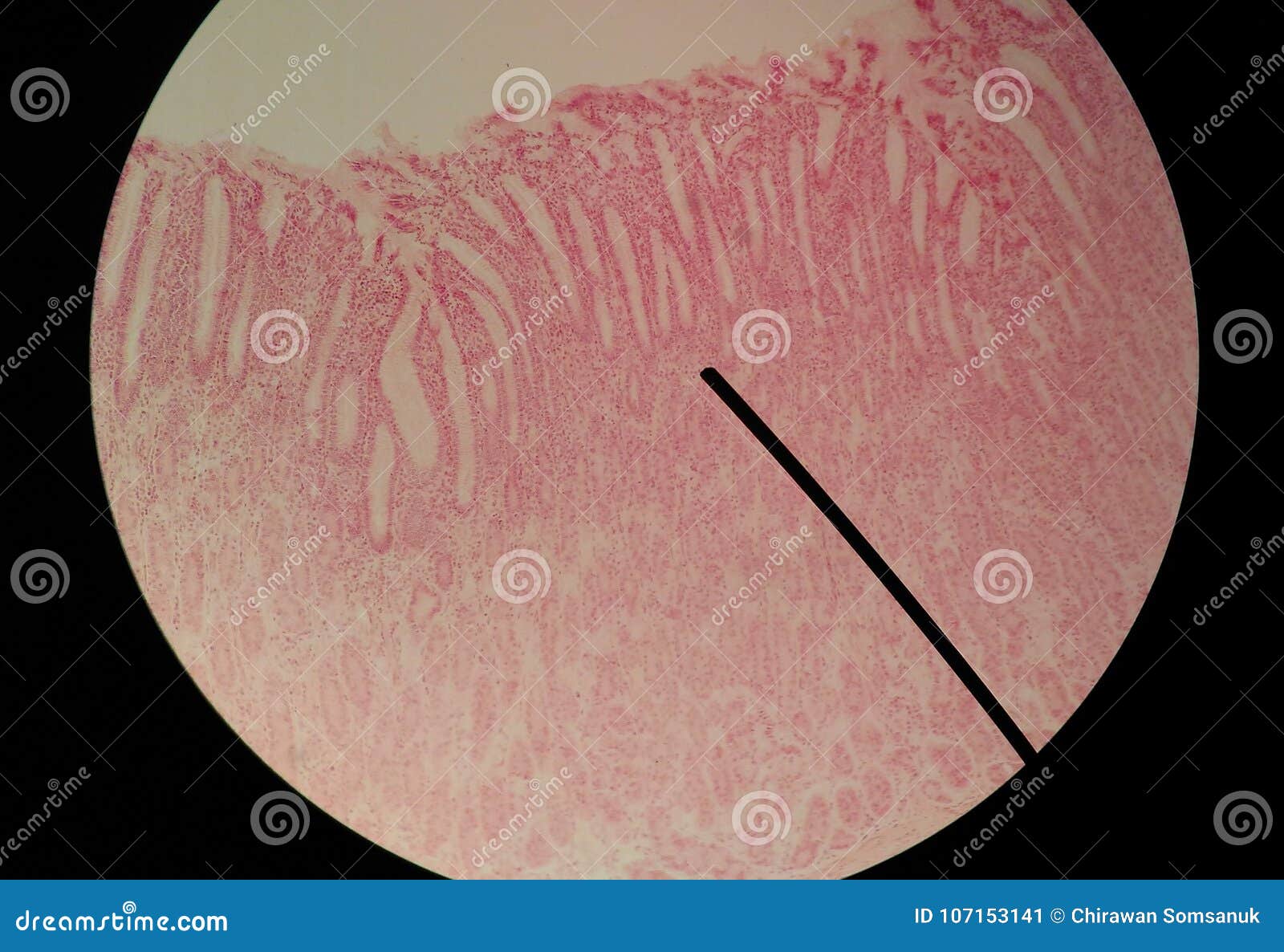 Close Up Human Cells with Microscope. Stock Image - Image of medicine ...