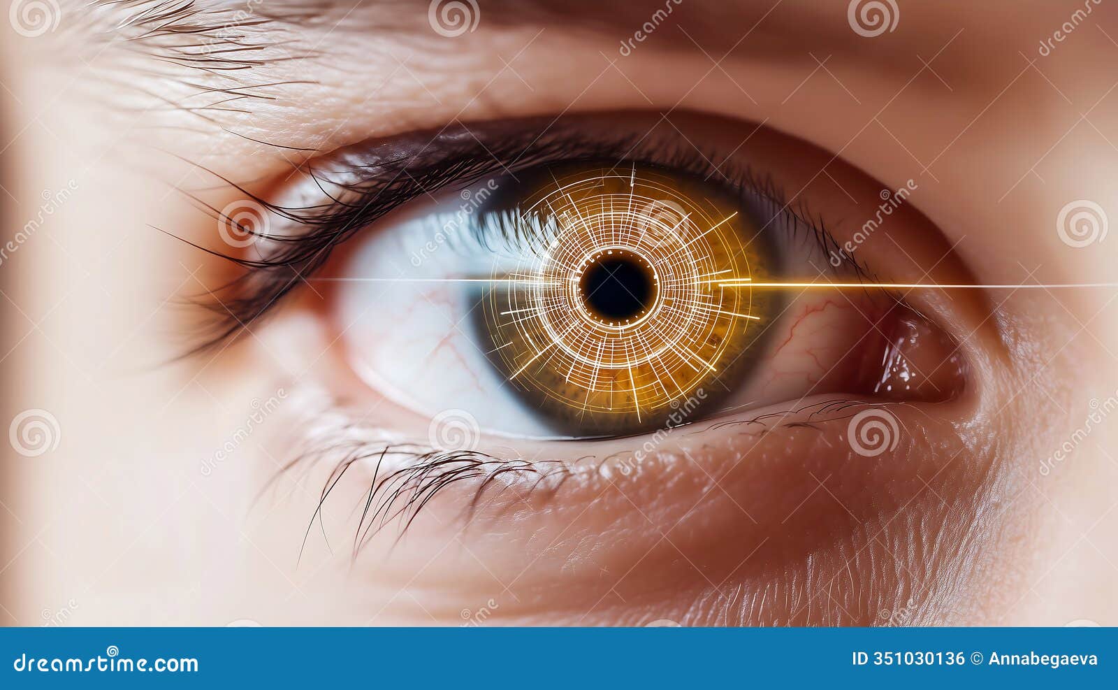 Human Eye - Retinal Detachment Stock Illustration | CartoonDealer.com ...