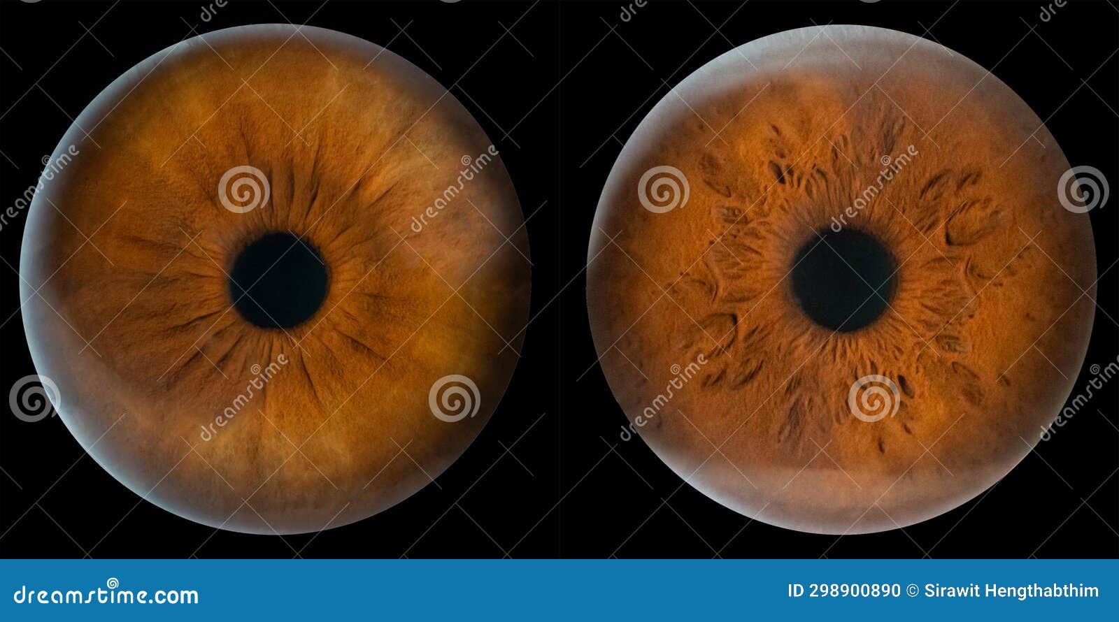 Close Up of Human Eye Iris Brown Color Details on Black Background ...