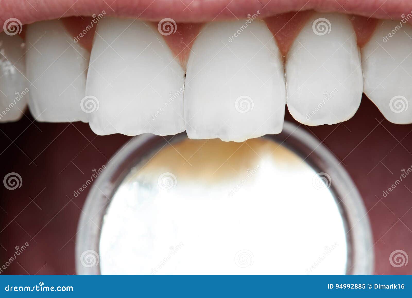 Close-up of Human Front Teeth Stock Image - Image of equipment ...