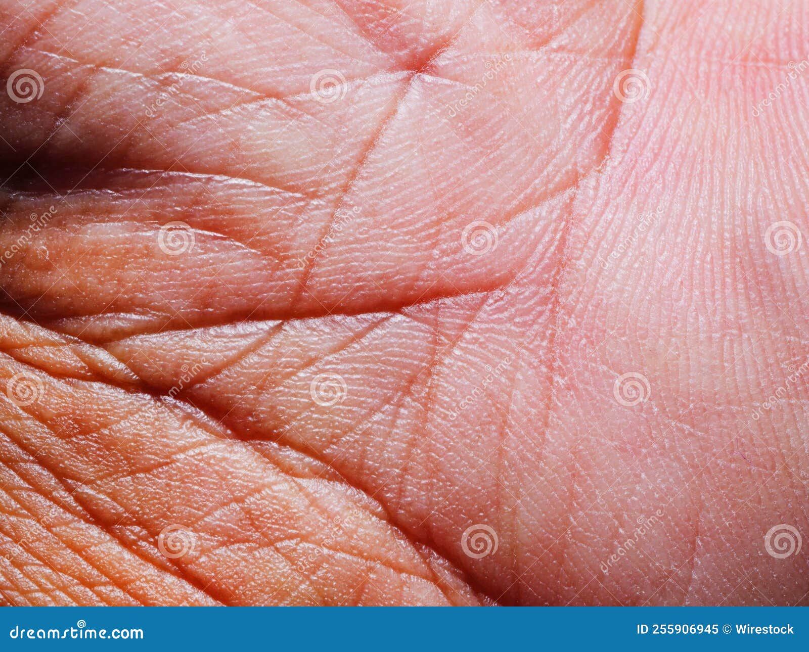 Close up of Human Skin stock image. Image of medicine - 255906945