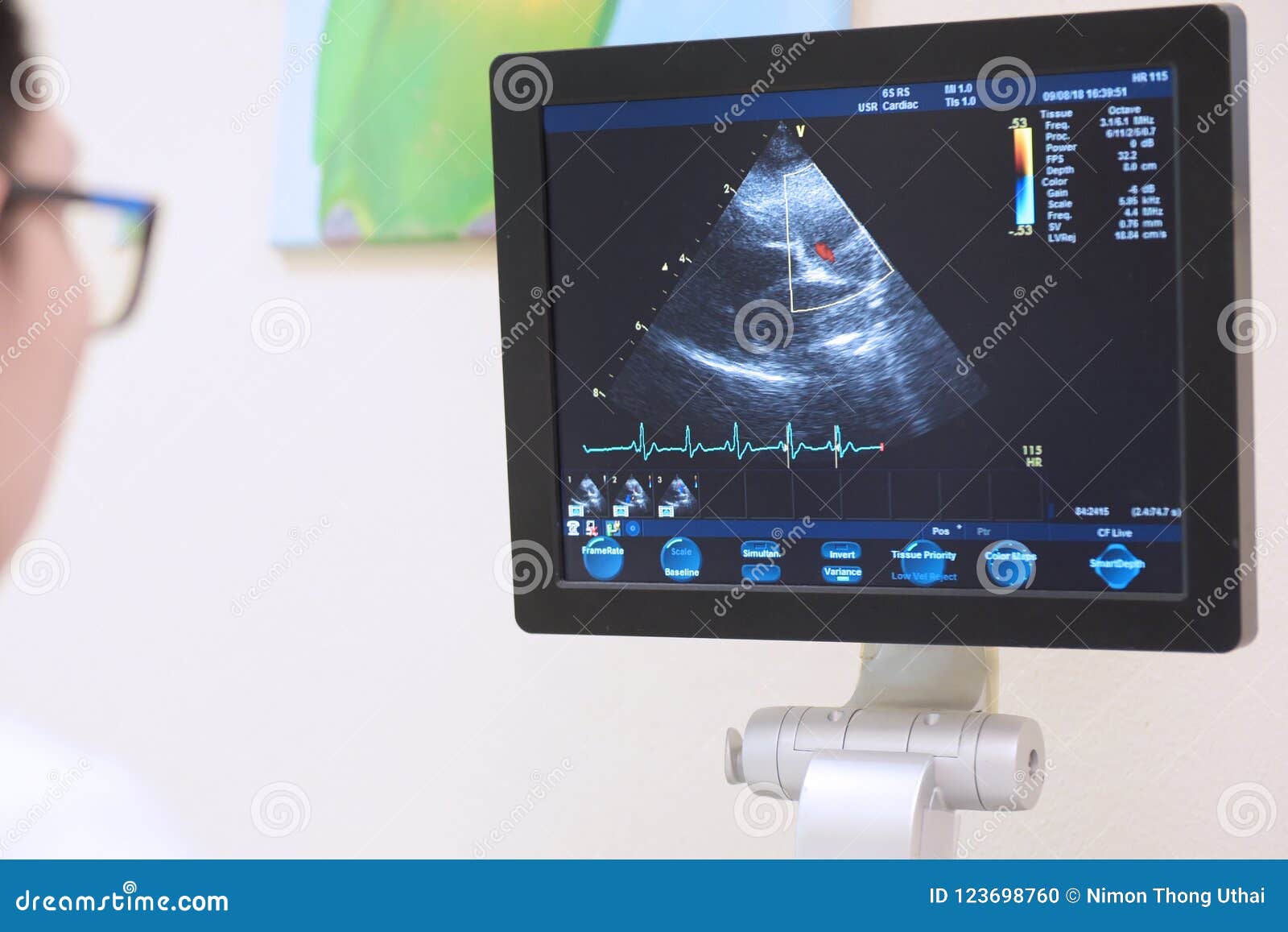 The Screen Of An Ultrasound Device With A Sagittal Brain Scan An ...
