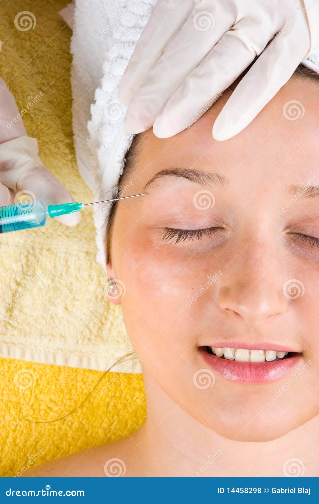 Close Up of Injection with Botox in Eyebrow Stock Photo - Image of ...