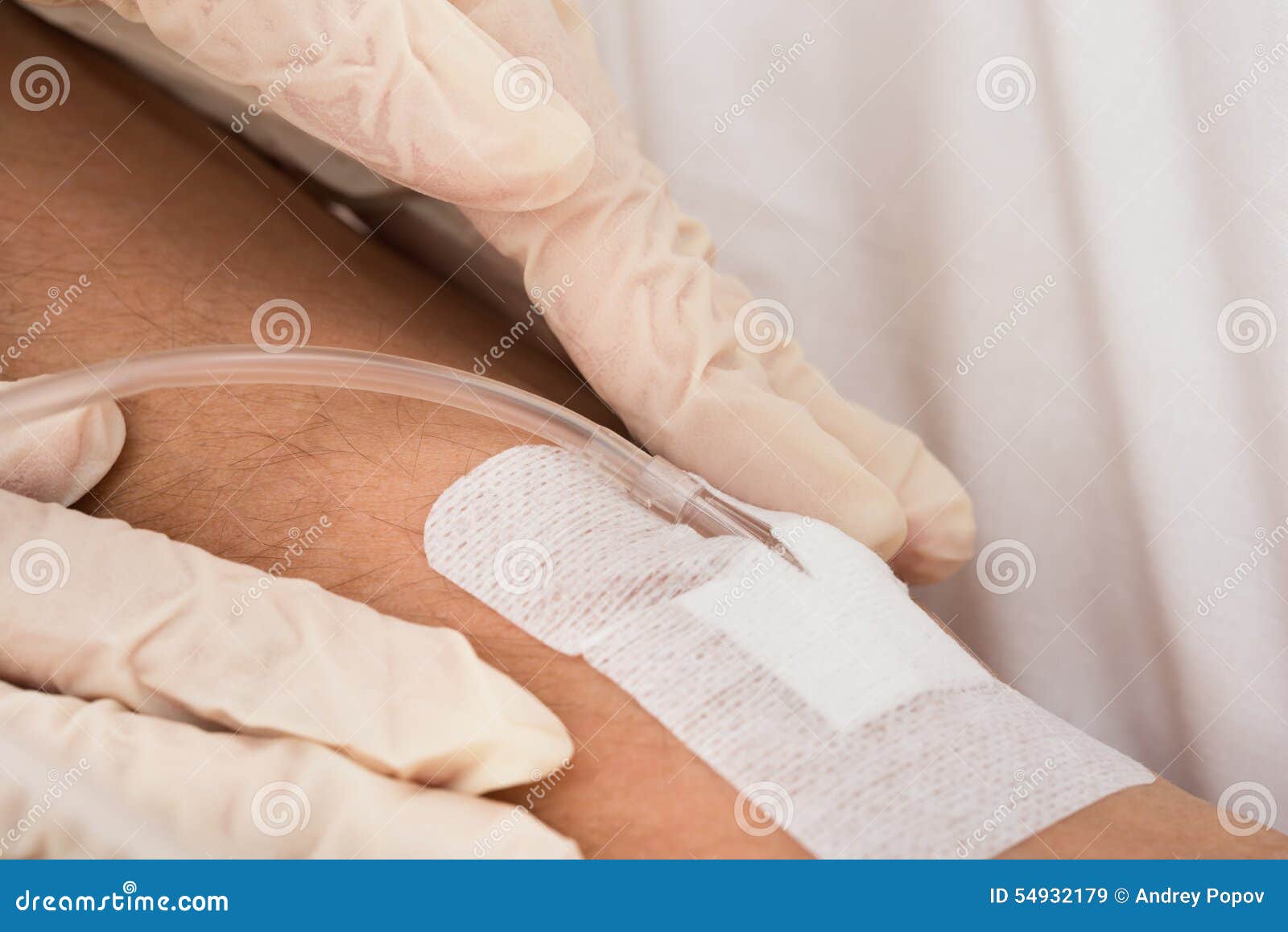 Close-up of a Iv Drip in Patient S Hand Stock Image - Image of ...