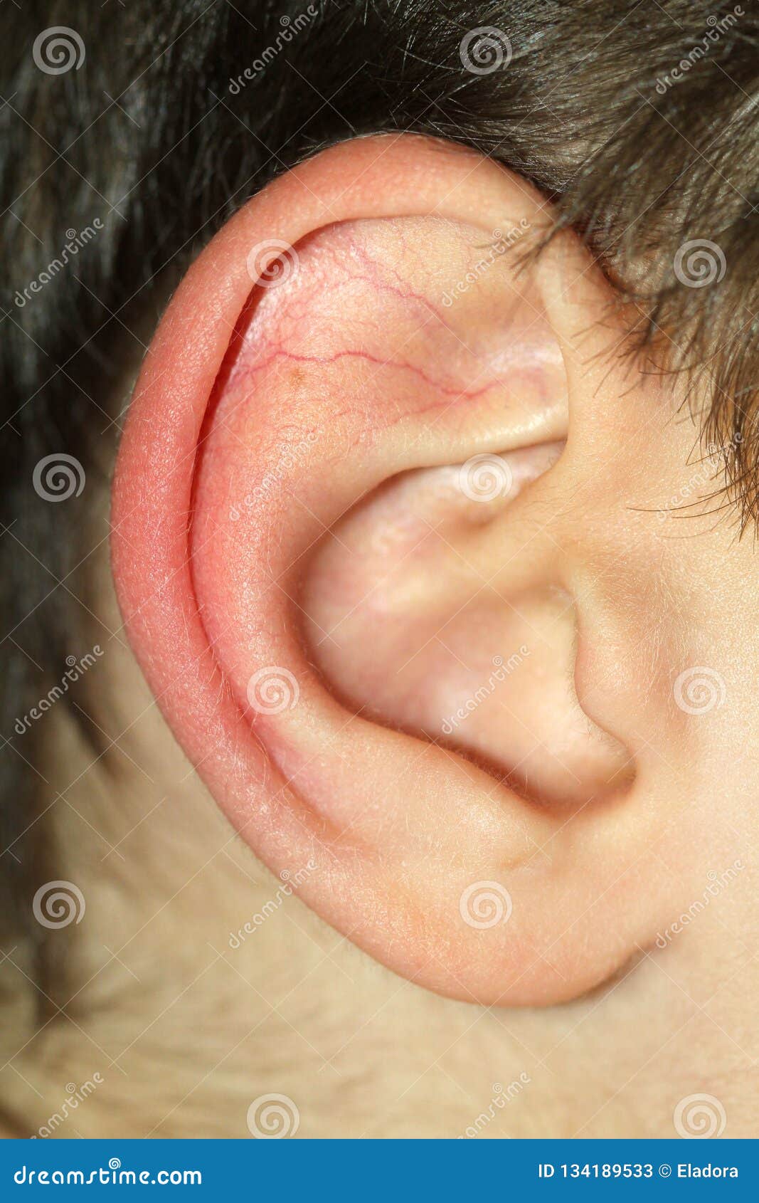 Close Up a Kids Ear, Body Part - Image Stock Image - Image of human ...